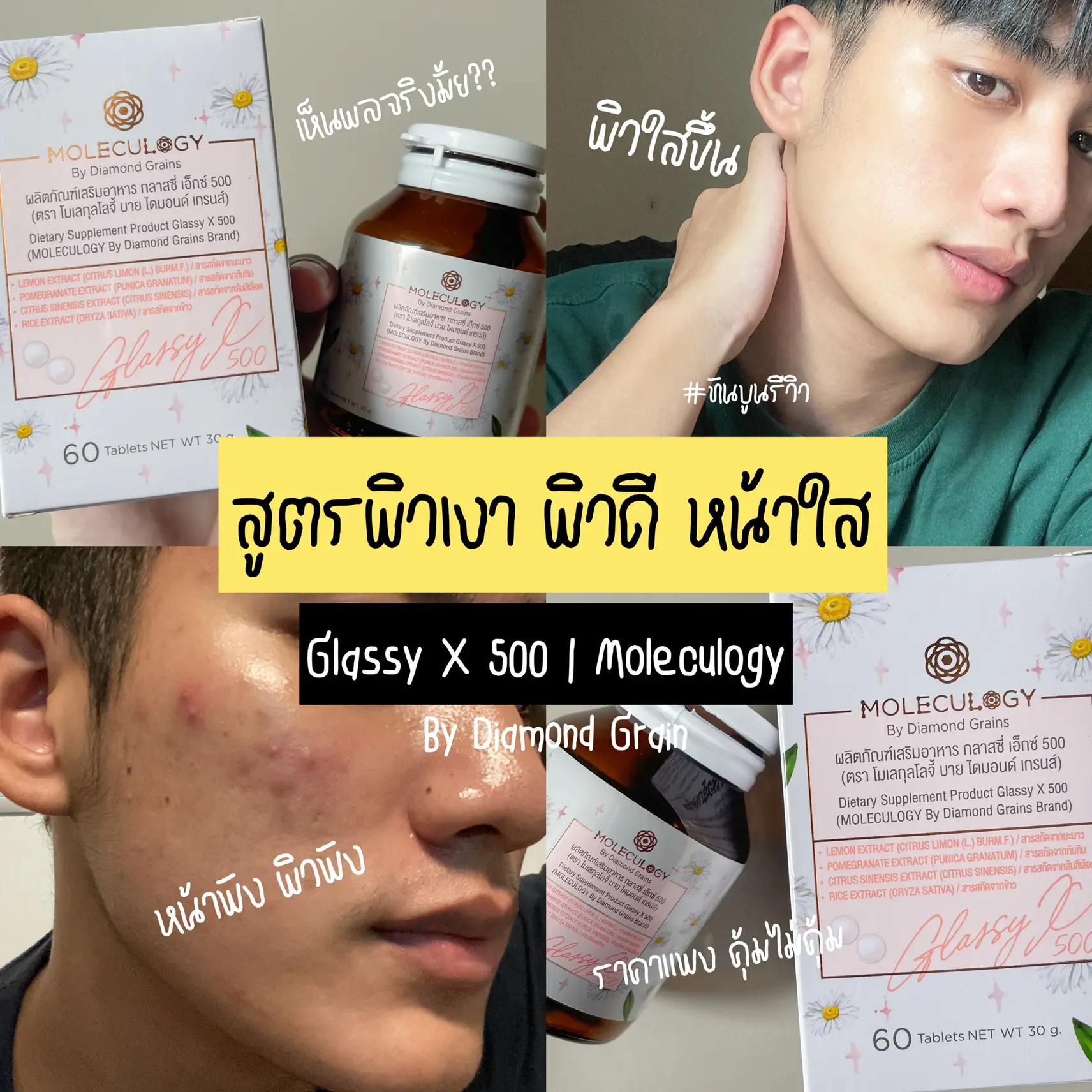 รีวิวสกินเเคร์ Ep.06 | Glassy X500 ผิวกระจกมีจริงมั้ย??!! | แกลเลอรีที่ ...