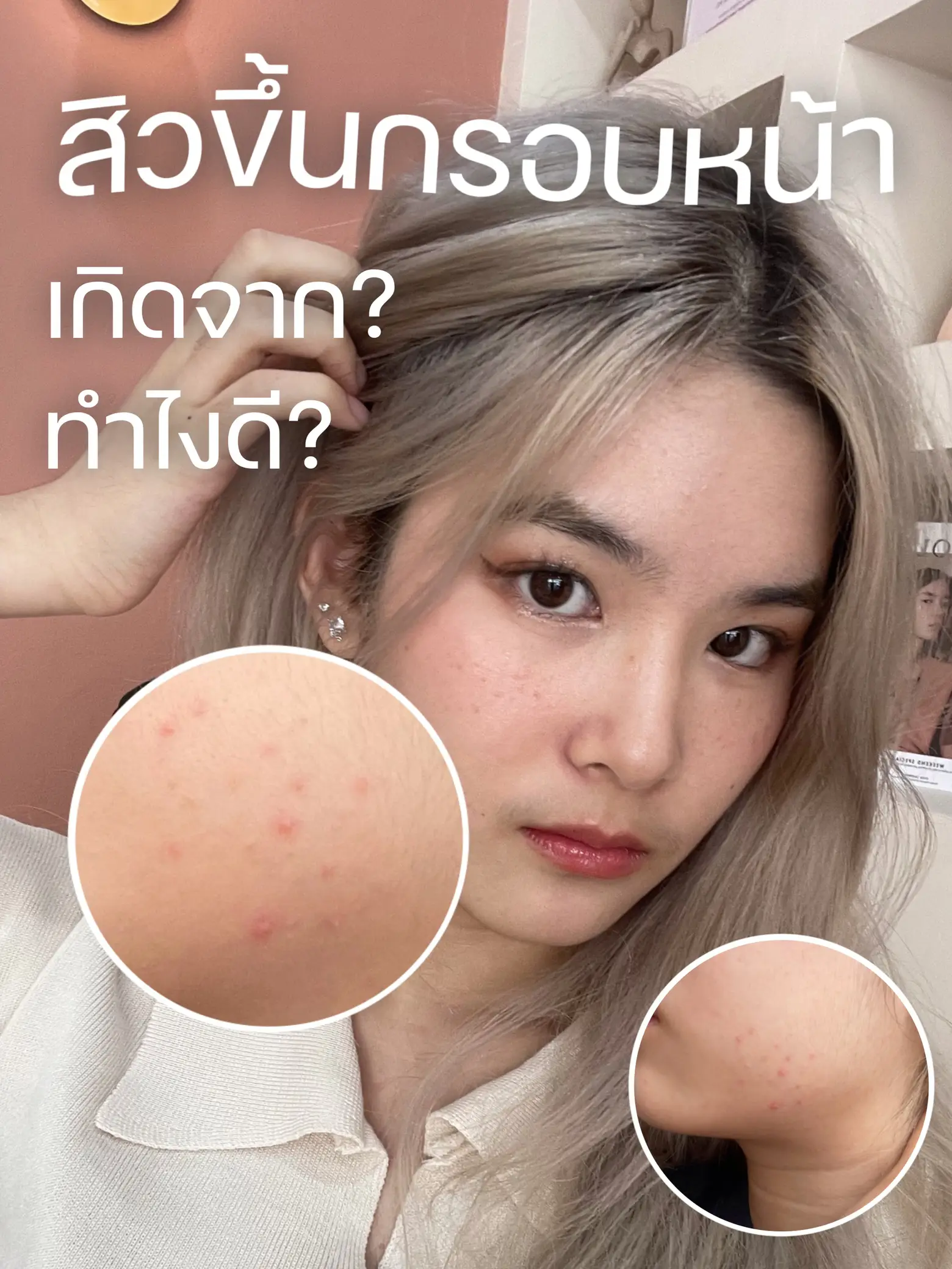 ช่วยด้วย😭 ทำไมขึ้นกรอบหน้าแบบนี้📌 | แกลเลอรีที่โพสต์โดย Poly.Reen | Lemon8