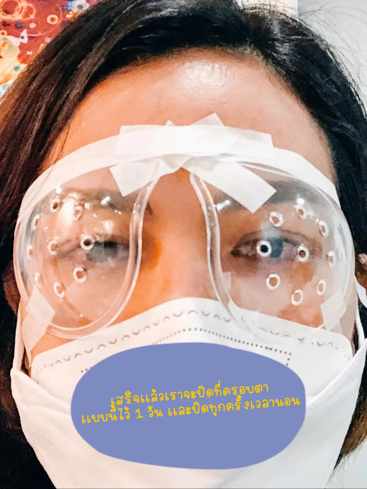 Femto Lasik | สาวสายตาสั้นโยนเเว่นทิ้งไปเลยจ้า | แกลเลอรีที่โพสต์โดย ...