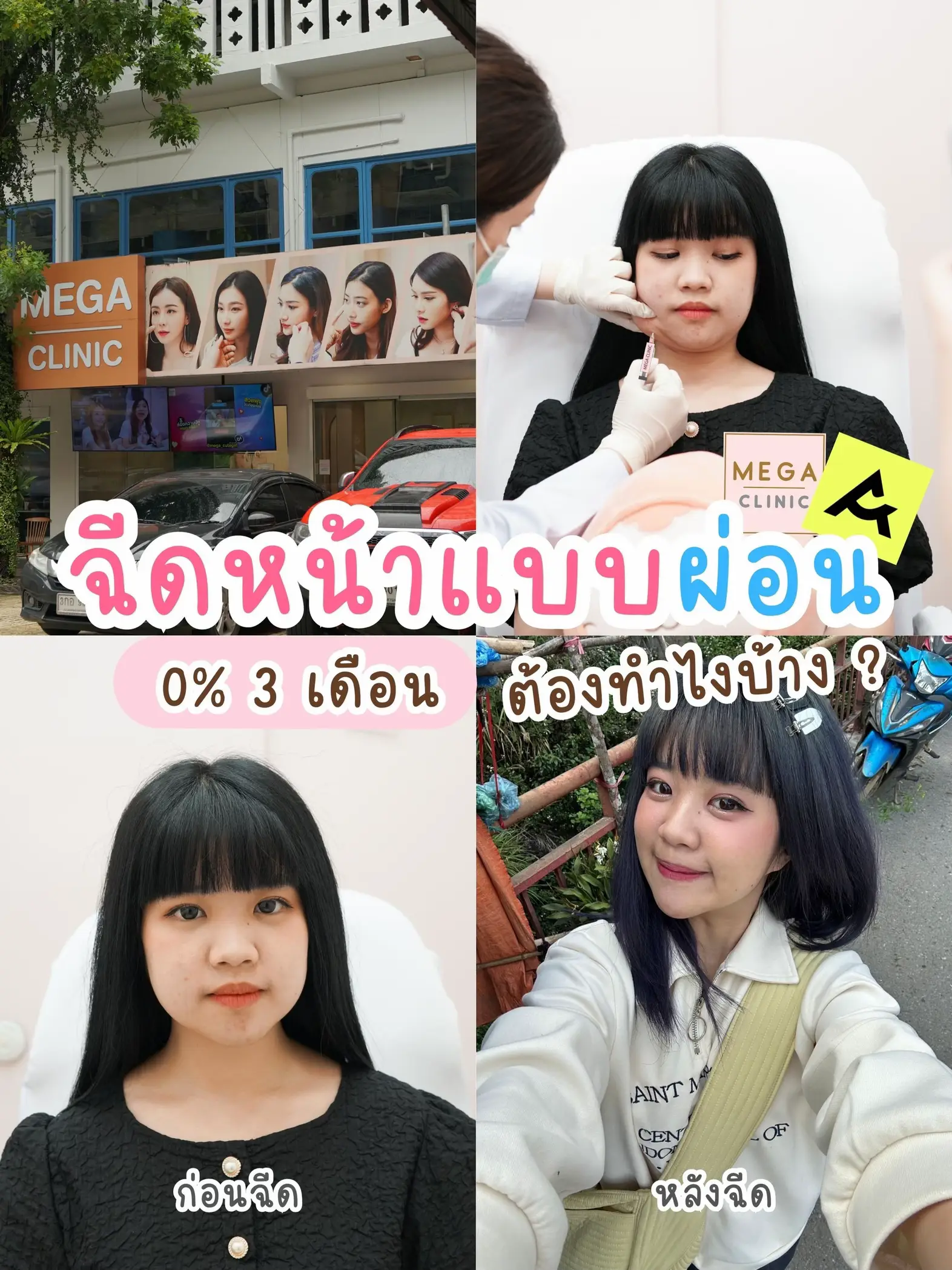 วิธีทำสวยแบบผ่อน 0% 💸สวยขึ้นแต่เงินไม่ช็อต ทำไงมาดู👀 | แกลเลอรีที่โพสต์โดย MEGA Beauty | Lemon8