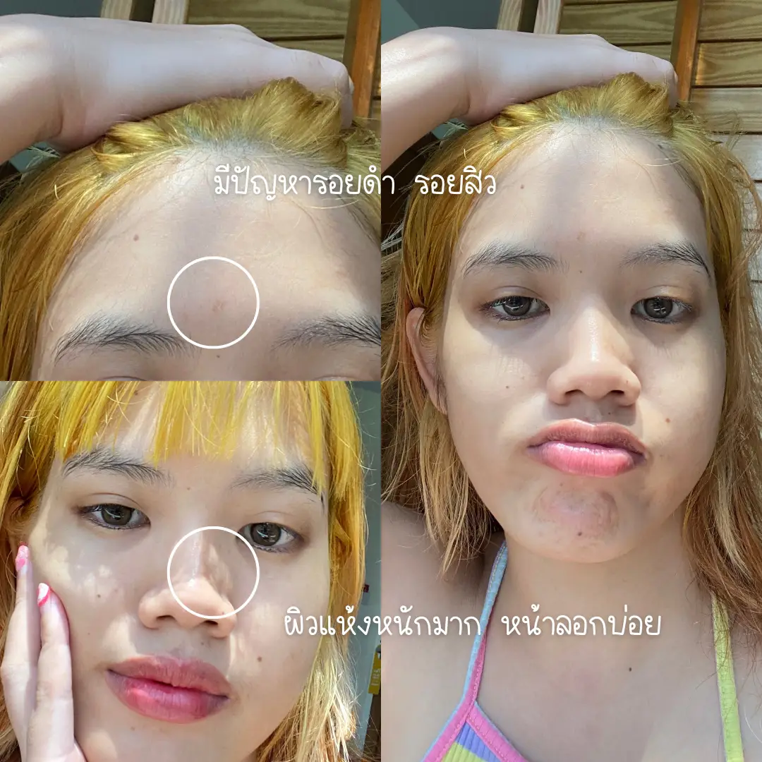 ผิวสวยขึ้น 3000% | แกลเลอรีที่โพสต์โดย Nurse Jittamas | Lemon8