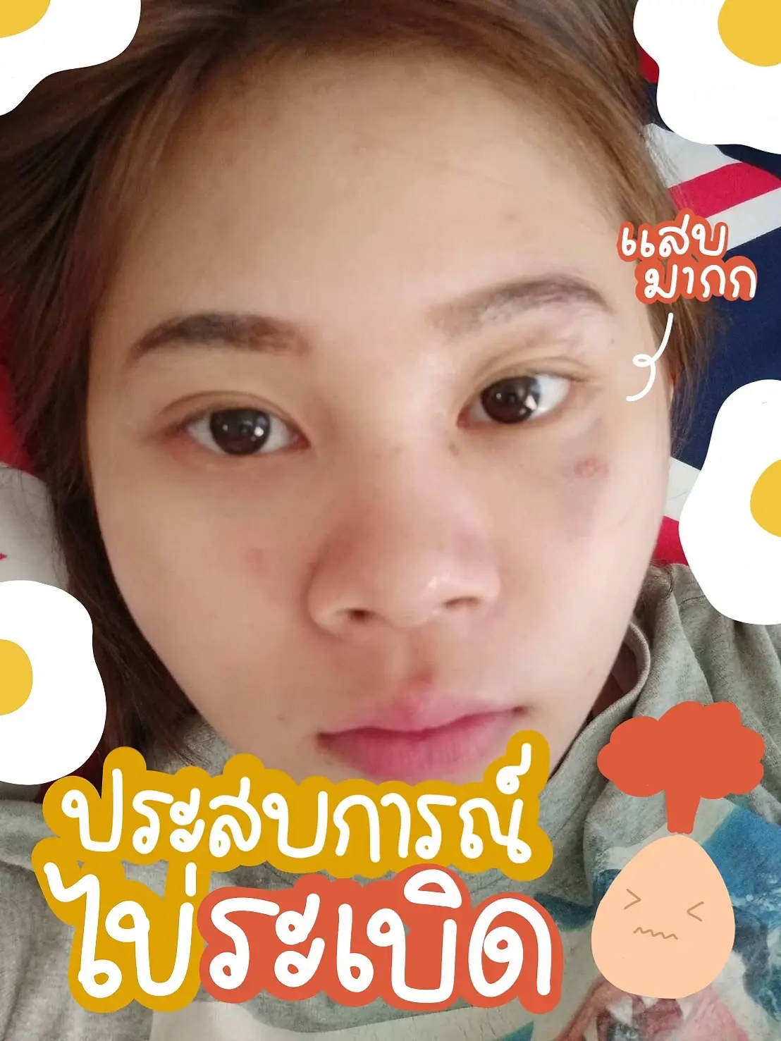 เรื่องนี้สอนให้รู้ว่า...อย่าต้มไข่ในไมโครเวฟ 🥚 | แกลเลอรีที่โพสต์โดย Eyelada | Lemon8