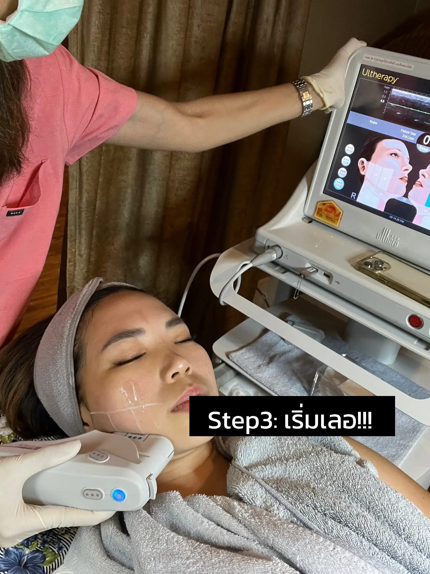 Ulthera เครื่องแท้จากUSA สำหรับสาววัย30+ ผู้ไม่ยอมเหี่ยวย่น | แกลเลอรีที่โพสต์โดย Kiki | Lemon8
