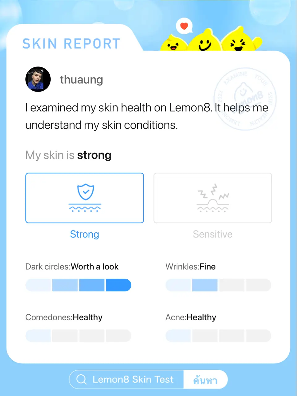 My Skin Report | แกลเลอรีที่โพสต์โดย THU AUNG | Lemon8