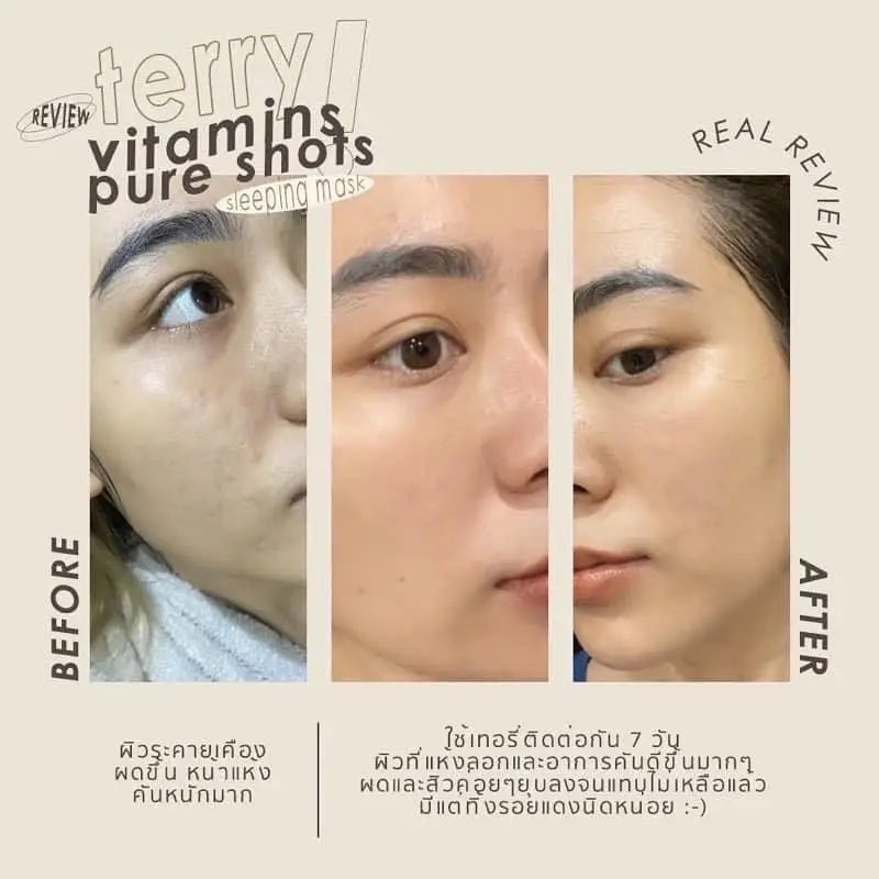 TERRY sleeping mask | แกลเลอรีที่โพสต์โดย Tic's | Lemon8