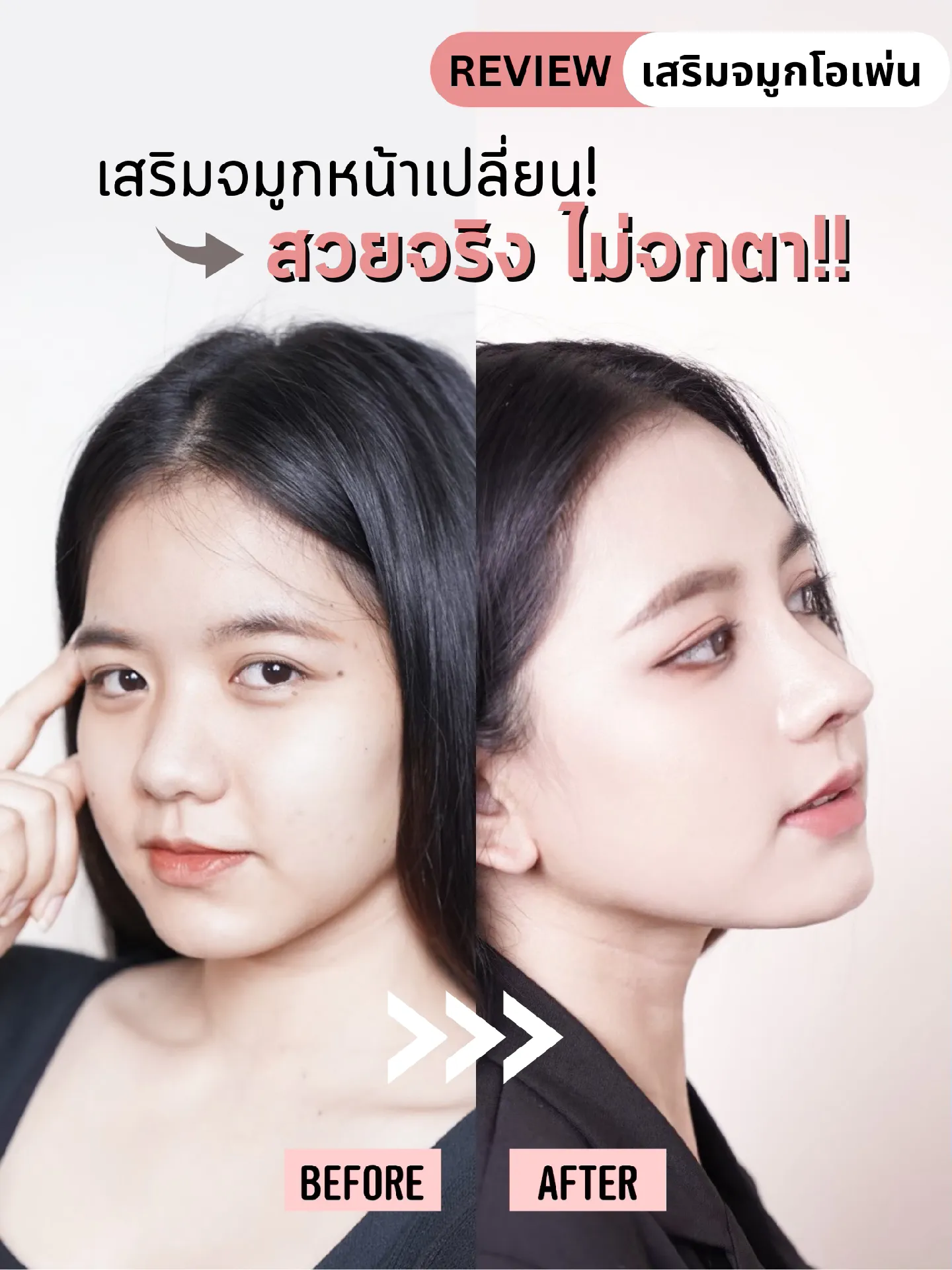 The nose has changed. Really beautiful.‼️ | Gallery posted by NSC ...