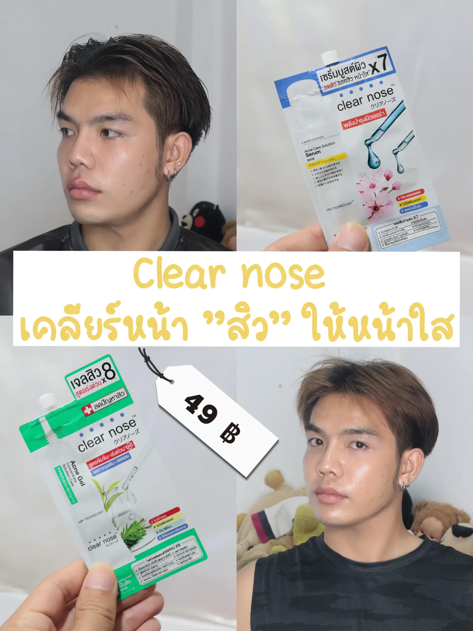 💥Review Clear Nose ใช้แล้วเห็นผลจริงหรือไม่? | แกลเลอรีที่โพสต์โดย cnanan.n | Lemon8