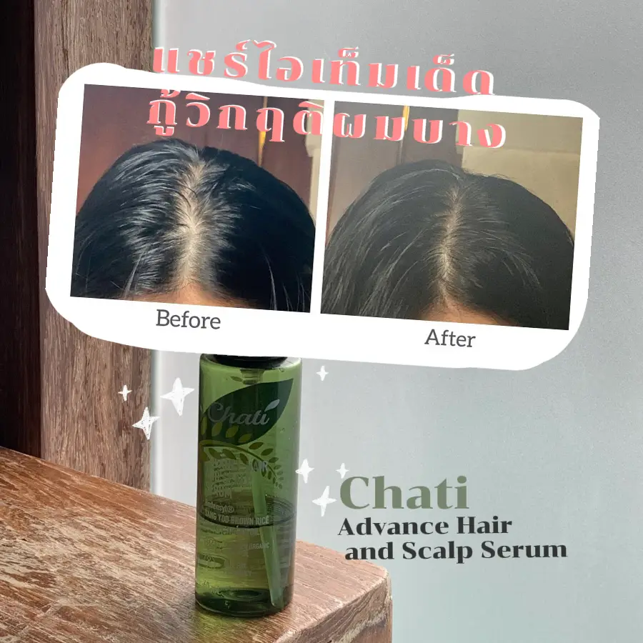 รีวิวเซรั่ม Chati ที่ทำให้รอยแสกของคนผมบางอย่างเราเปลี่ยนไป ️ | แกลเลอรีที่โพสต์โดย plea.surely ...