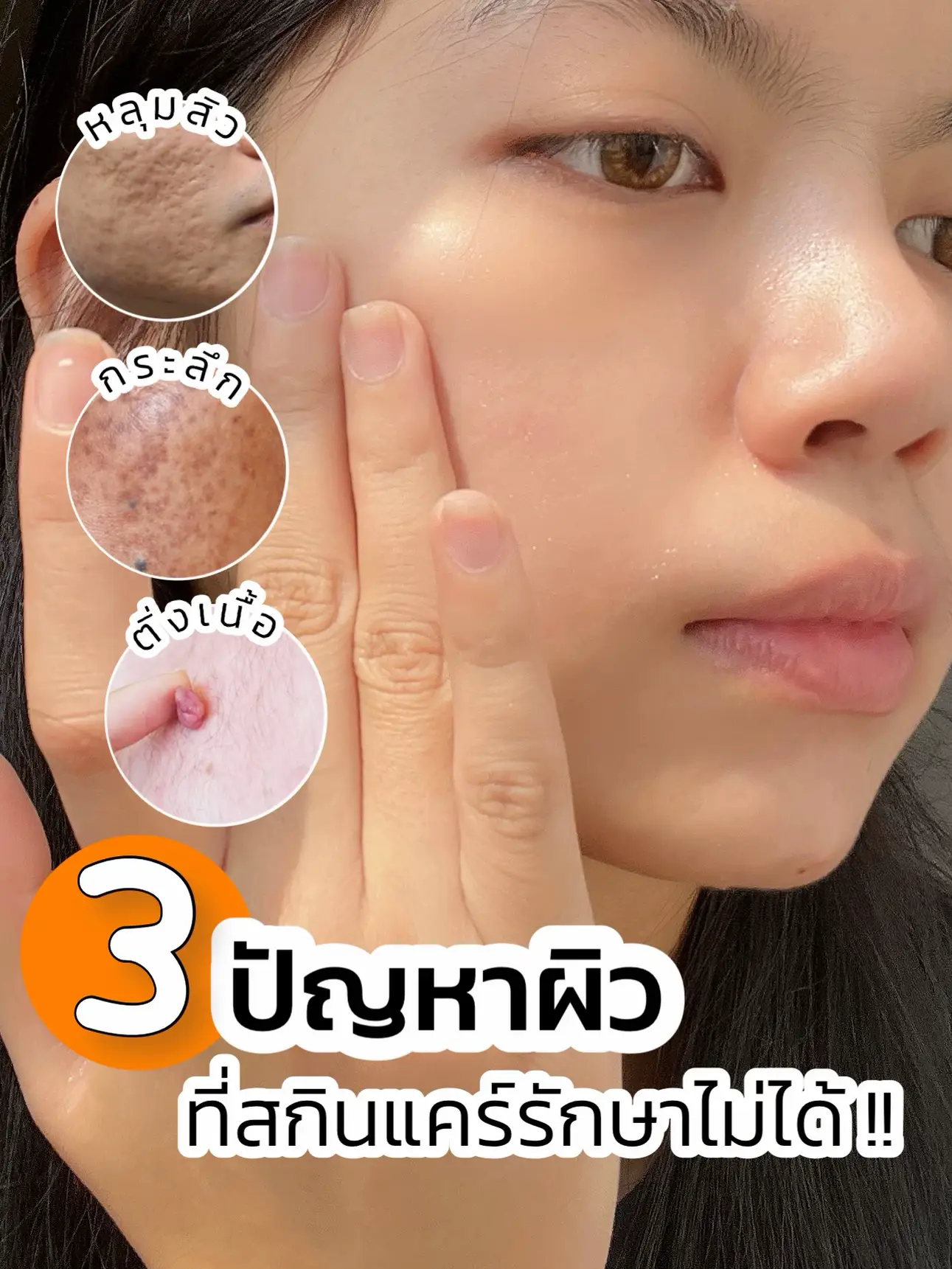 3 Skin problems that skin care does not cure?! | Gallery posted by ...