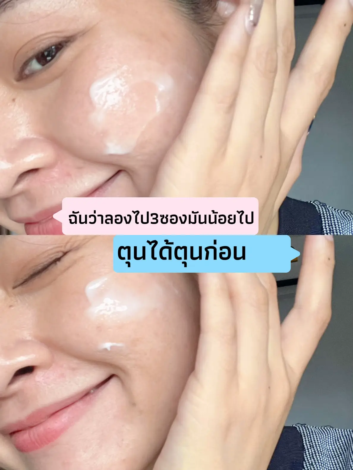 **BK Acne Expert Filler Bright ใครลองบ้างยัง** | แกลเลอรีที่โพสต์โดย Miiw | Lemon8