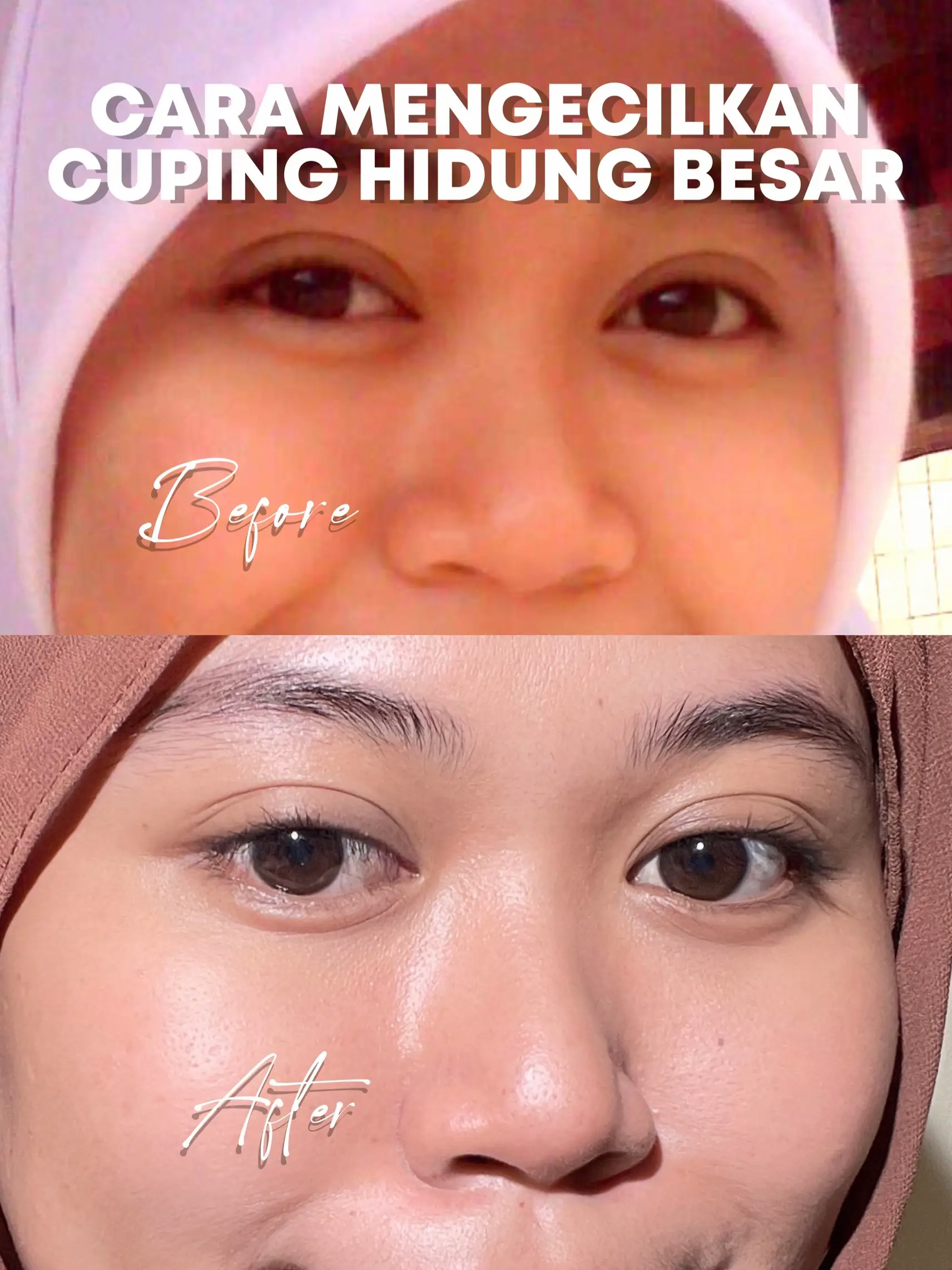 Cara agar hidung tidak besar | 2025 pengalaman pengguna asli di Lemon8