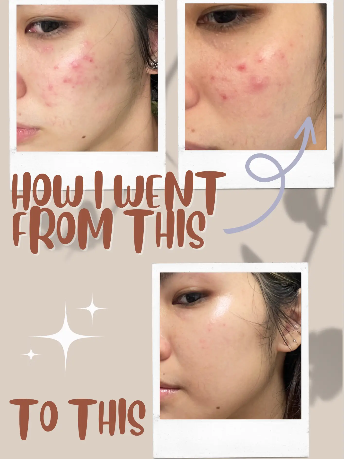 skin transformation??? | Gallery posted by jae4jiaqi | Lemon8