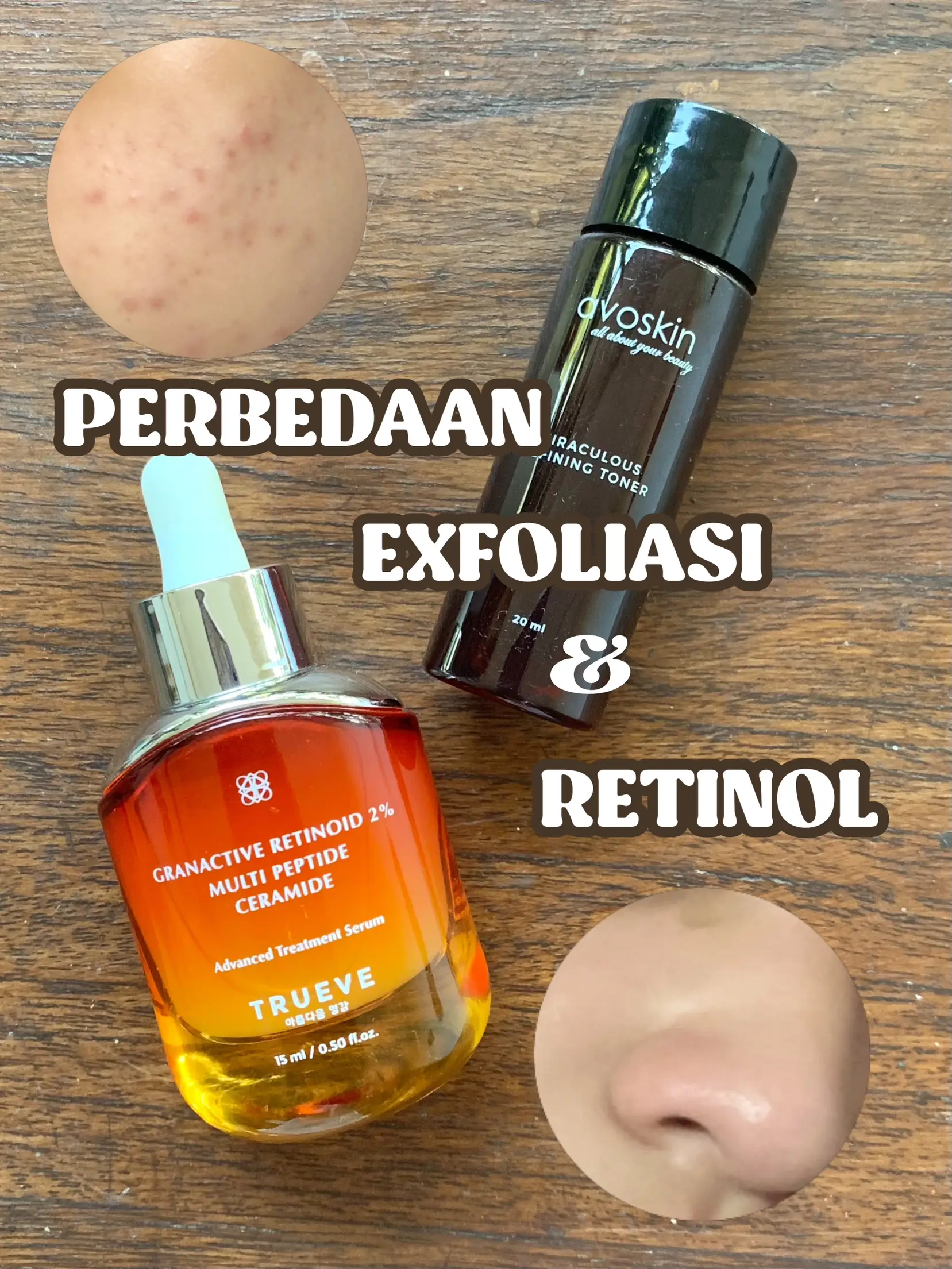 19 ide Perbedaan Retinol Dan Exfoliasi teratas di 2024