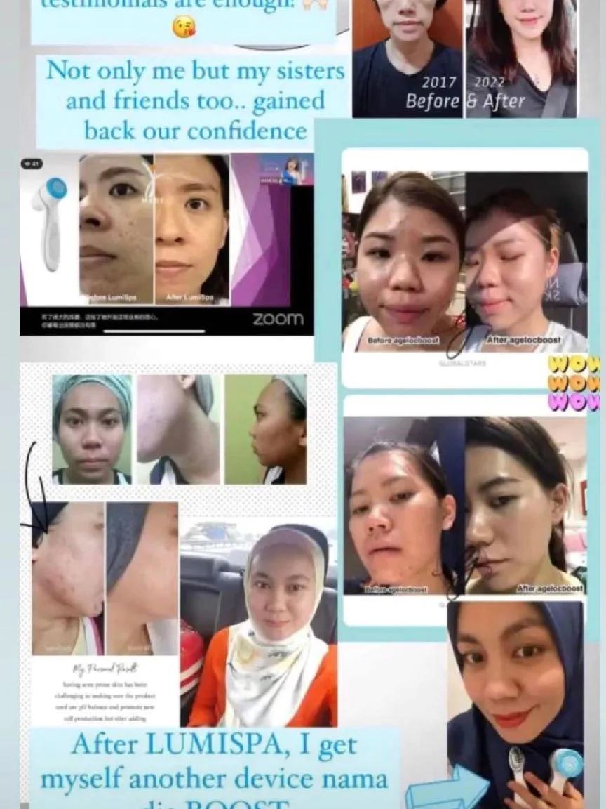 Lumi IO help my face glow | Galeri disiarkan oleh Serena Ong | Lemon8