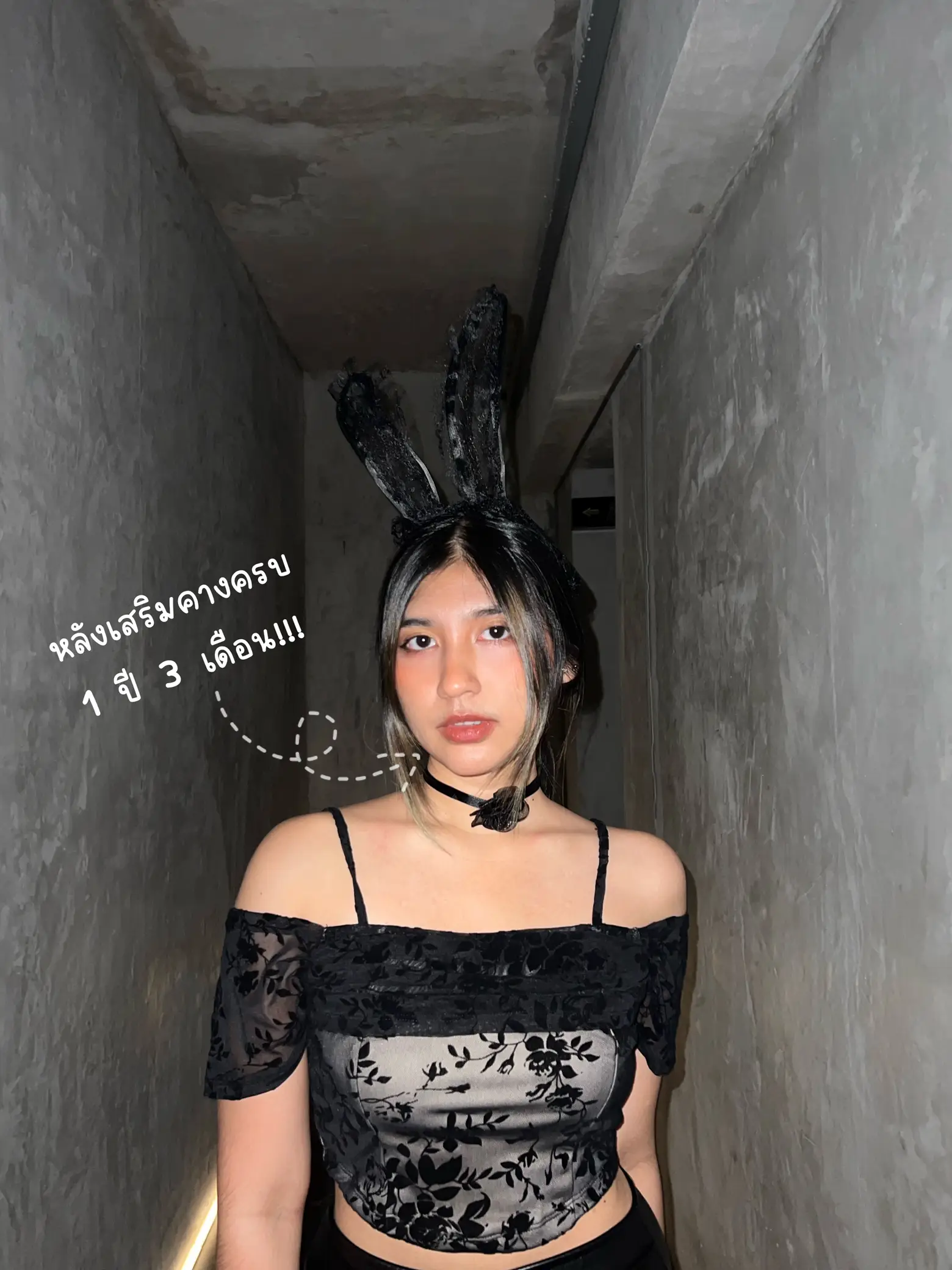 รีวิวศัลยกรรม (เสริมคาง) ครั้งแรก!!!!💖 | แกลเลอรีที่โพสต์โดย beem | Lemon8