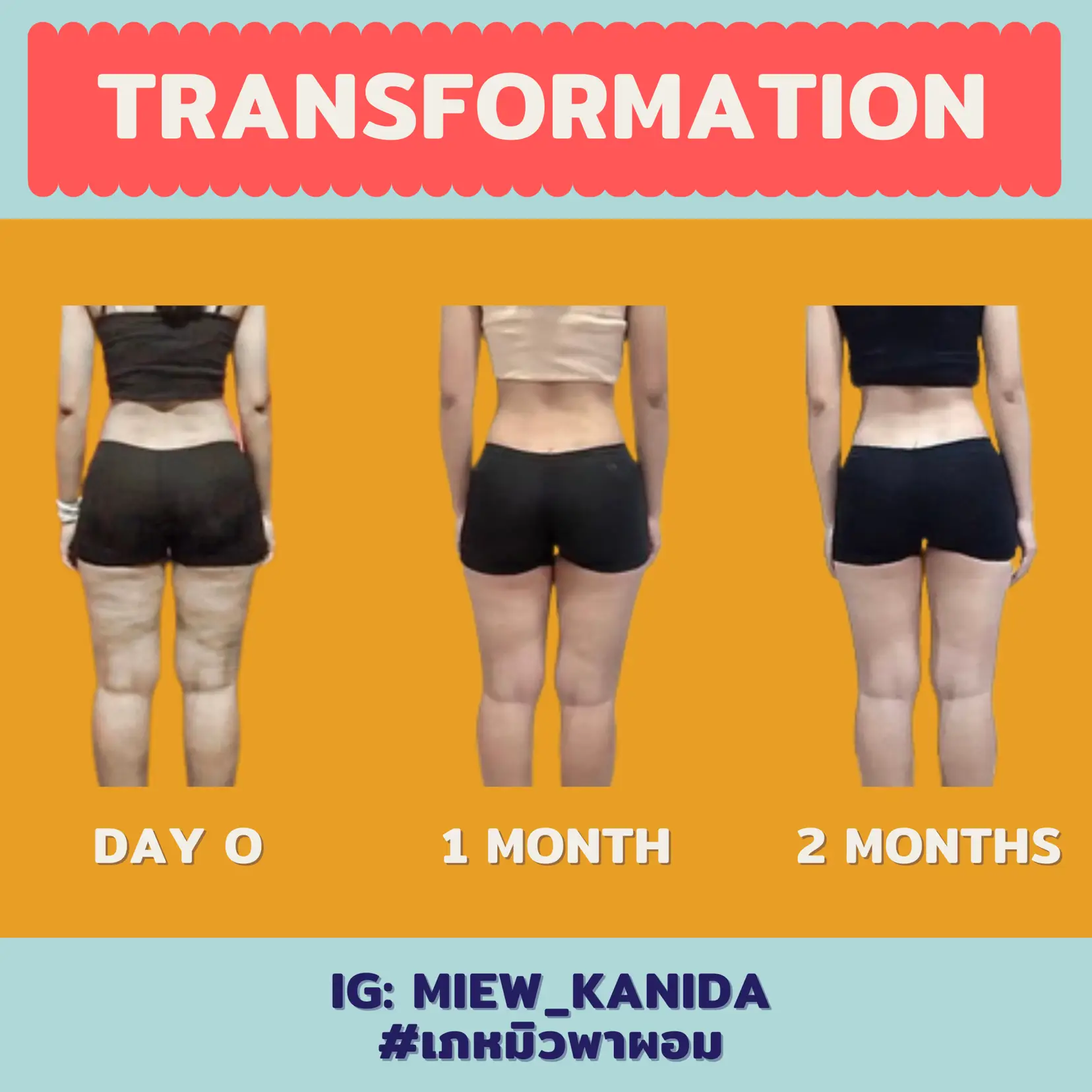 How to เซลลูไลท์หายเกลี้ยง…ภายใน 2 เดือน | แกลเลอรีที่โพสต์โดย Miew ...
