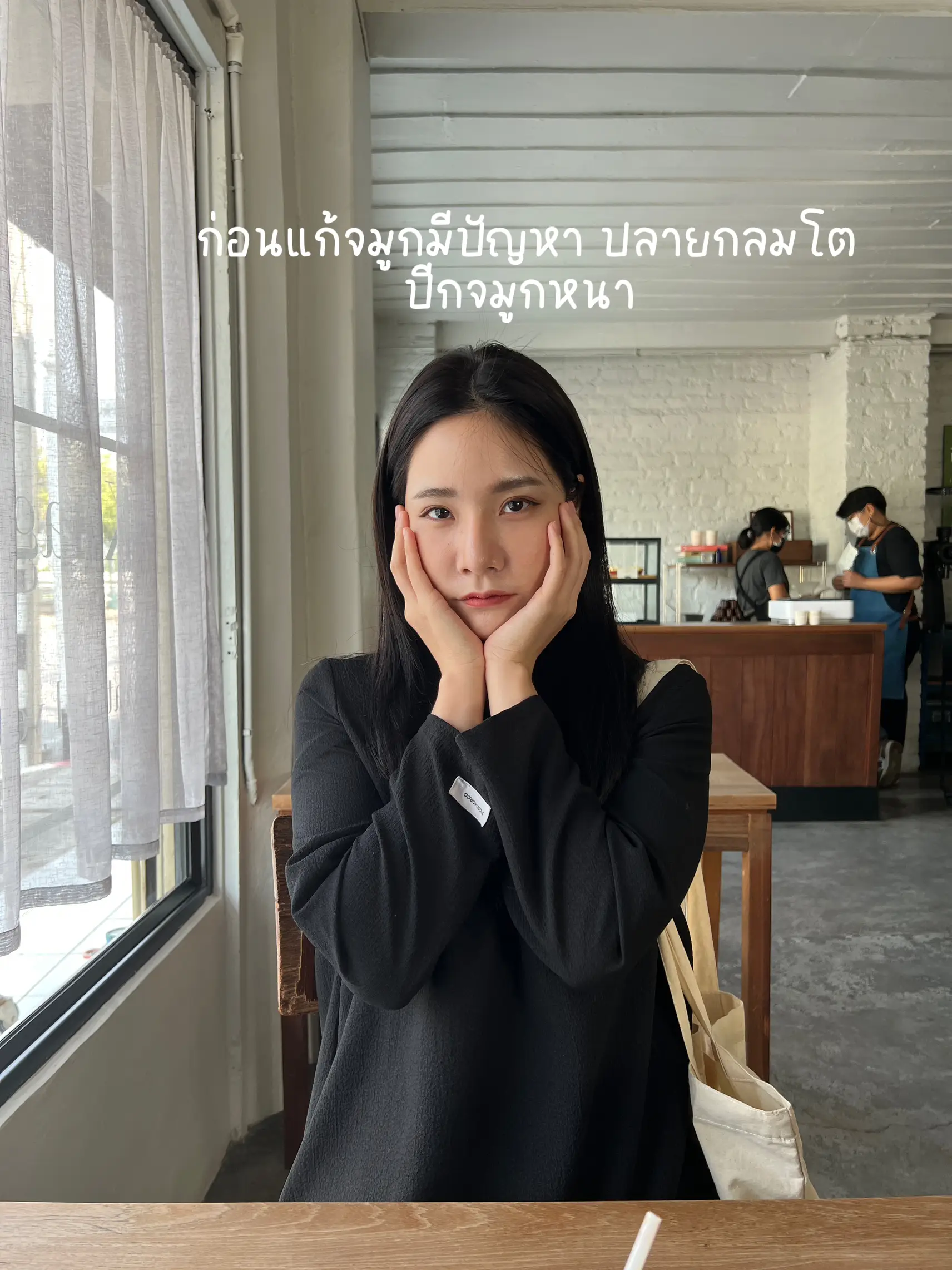 รีวิวประสบการณ์แก้จมูกกับคุณหมอไทย 380,000 บาท | แกลเลอรีที่โพสต์โดย ...