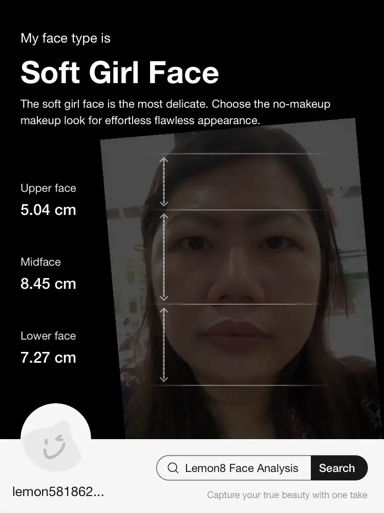 My Face Analysis Report | Galeri diposting oleh Laxmi Junita | Lemon8
