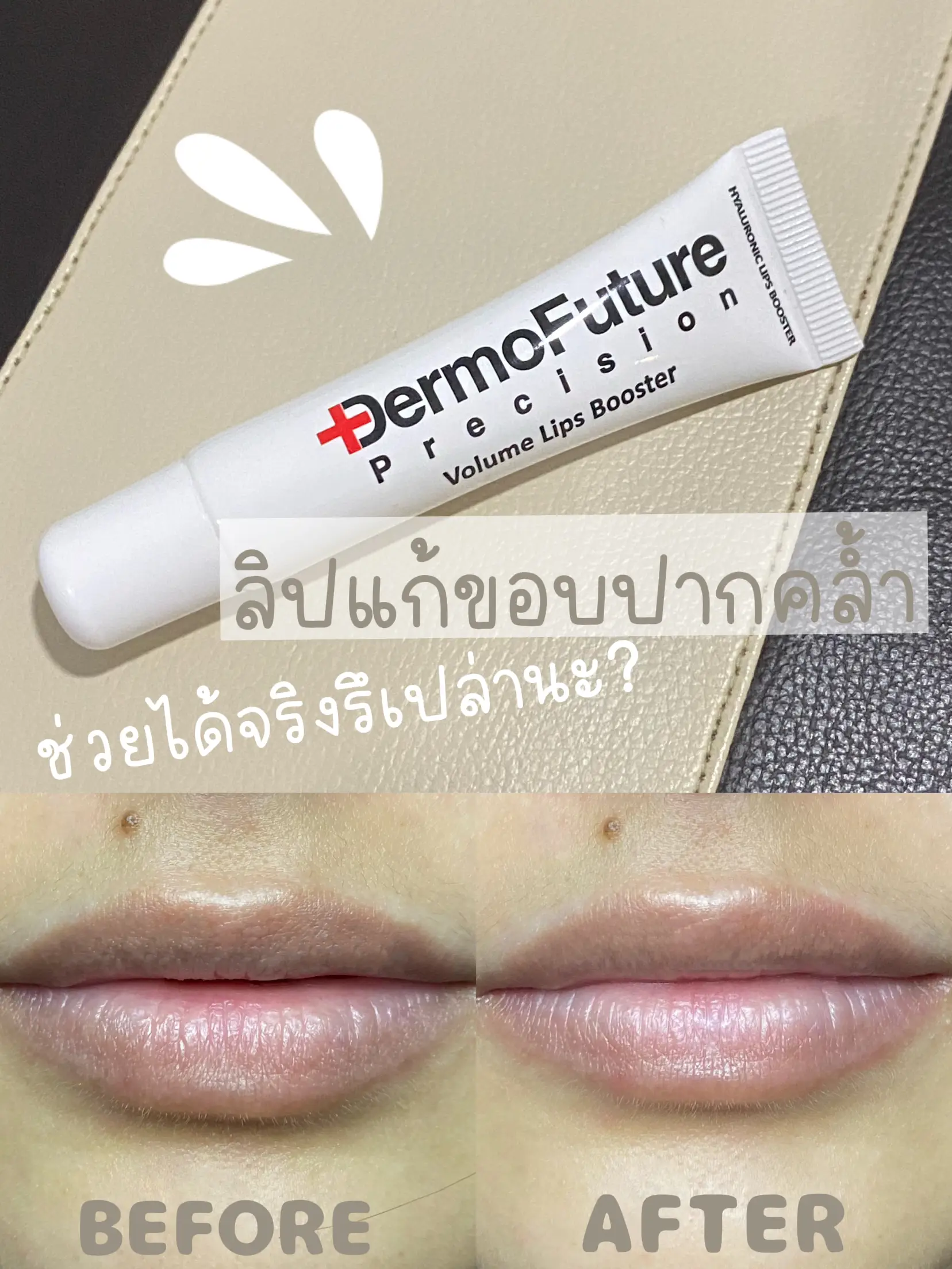 ปากหายคล้ำด้วยสิ่งนี้ 👄 | แกลเลอรีที่โพสต์โดย กานต์กันตา | Lemon8