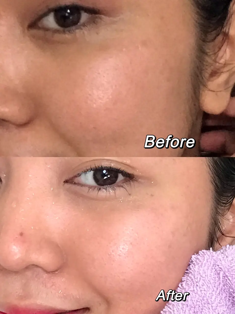 Cara untuk putih dengan lebih cepat menggunakan bu | Galeri disiarkan ...