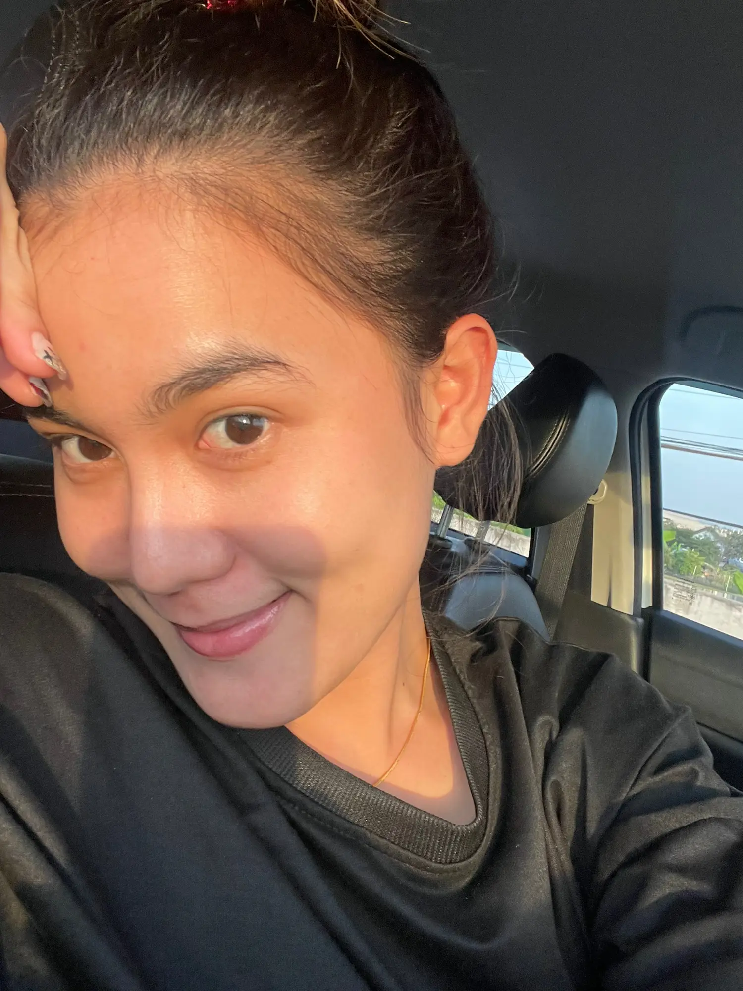 รักษาสิวเอง ฉบับโนสปอนจ้า!!! ️ | แกลเลอรีที่โพสต์โดย Seryoung sp | Lemon8