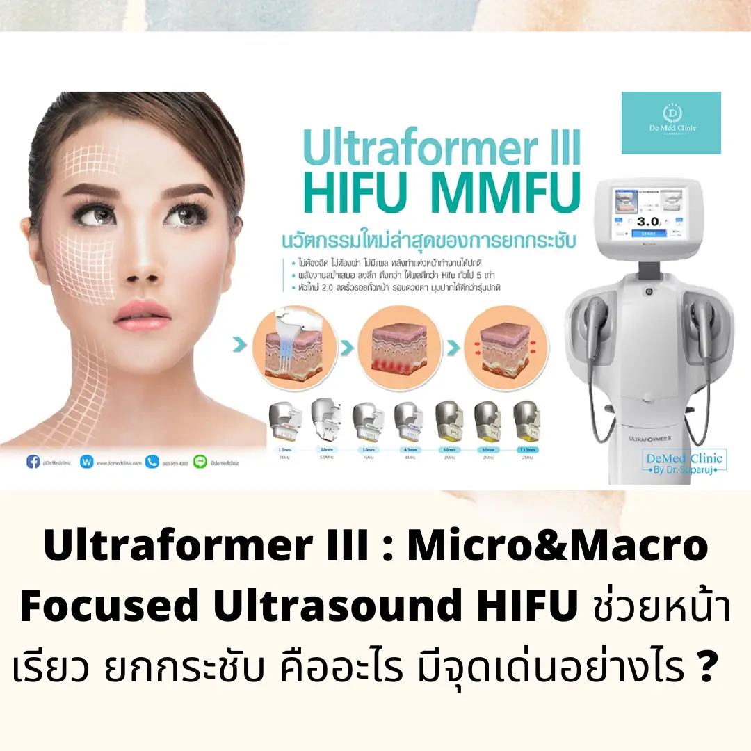 Ulthera Vs Hifu ยี่ห้อต่างๆ กับ, 55% OFF