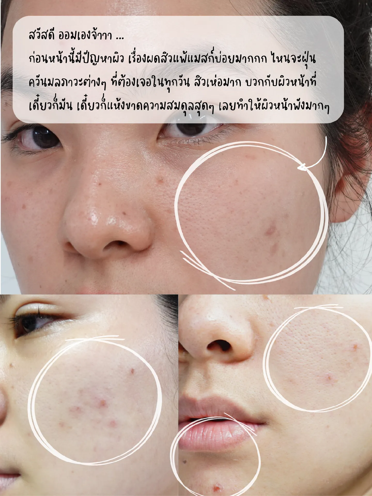 19 ไอเดียยอดนิยมเกี่ยวกับ Jk Lab เซรั่ม รีวิว Pantip ในปี 2024