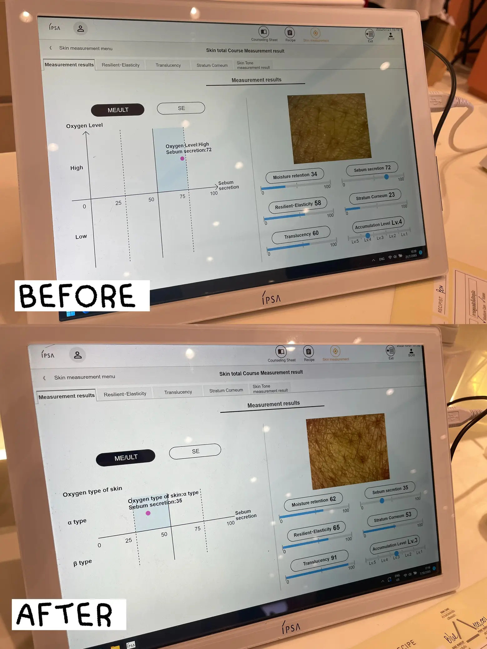 มาตรวจผิวรอบ 2 ที่ IPSA หลังใช้ผลิตภัณฑ์มา 2 เดือน🤍 | แกลเลอรีที่โพสต์โดย cinearism💀 | Lemon8