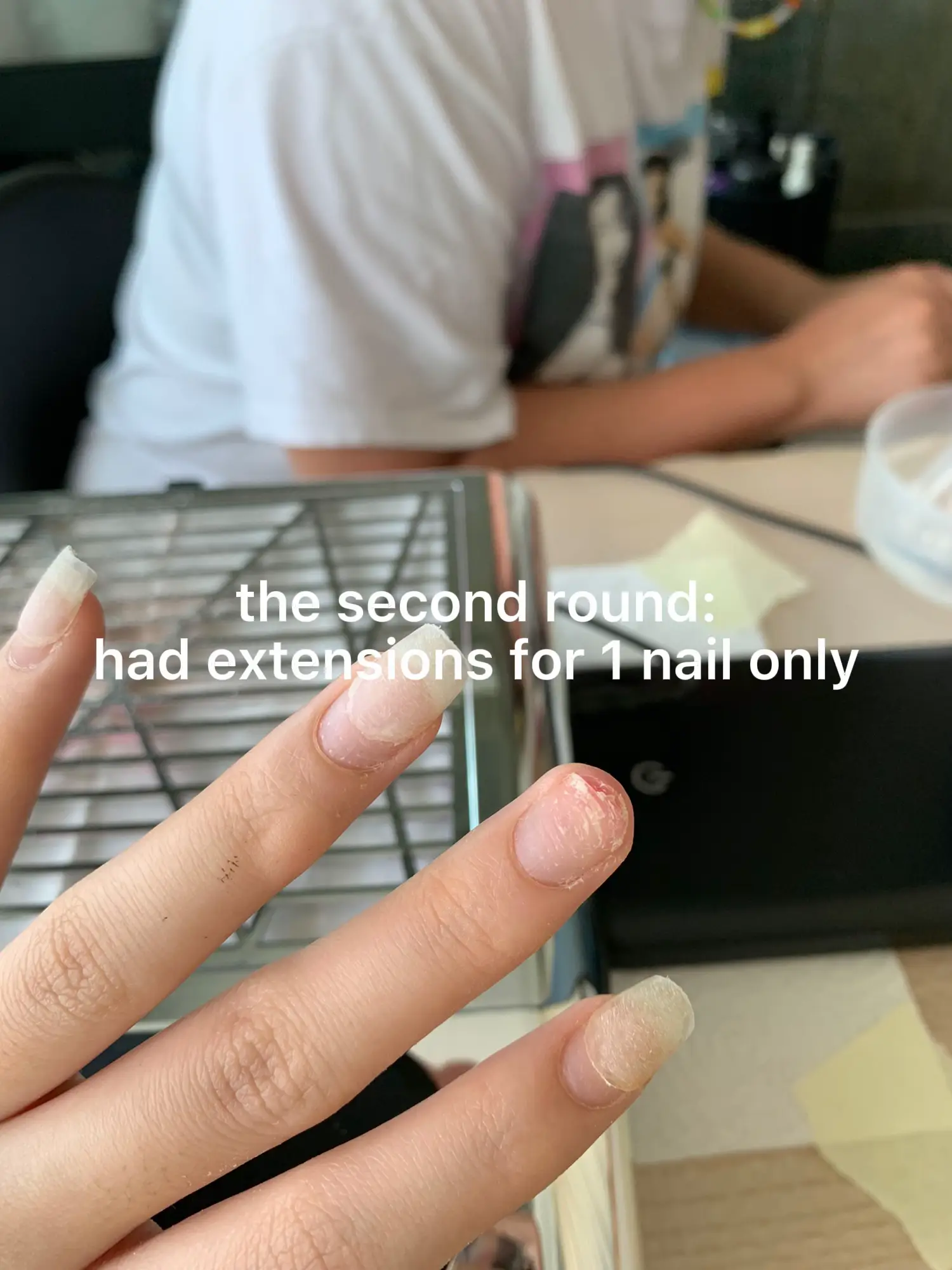 the end of nail pittings for me🥹 | แกลเลอรีที่โพสต์โดย jewel | Lemon8