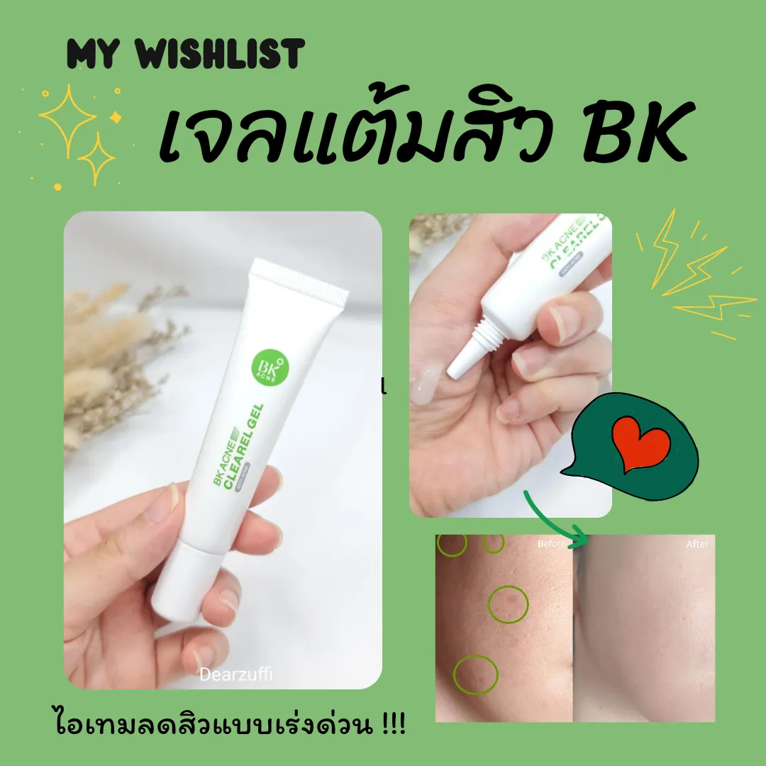 Continue the acne reduction item BK helps acne collapse quickly! | Gallery posted by Dearzuffi ...
