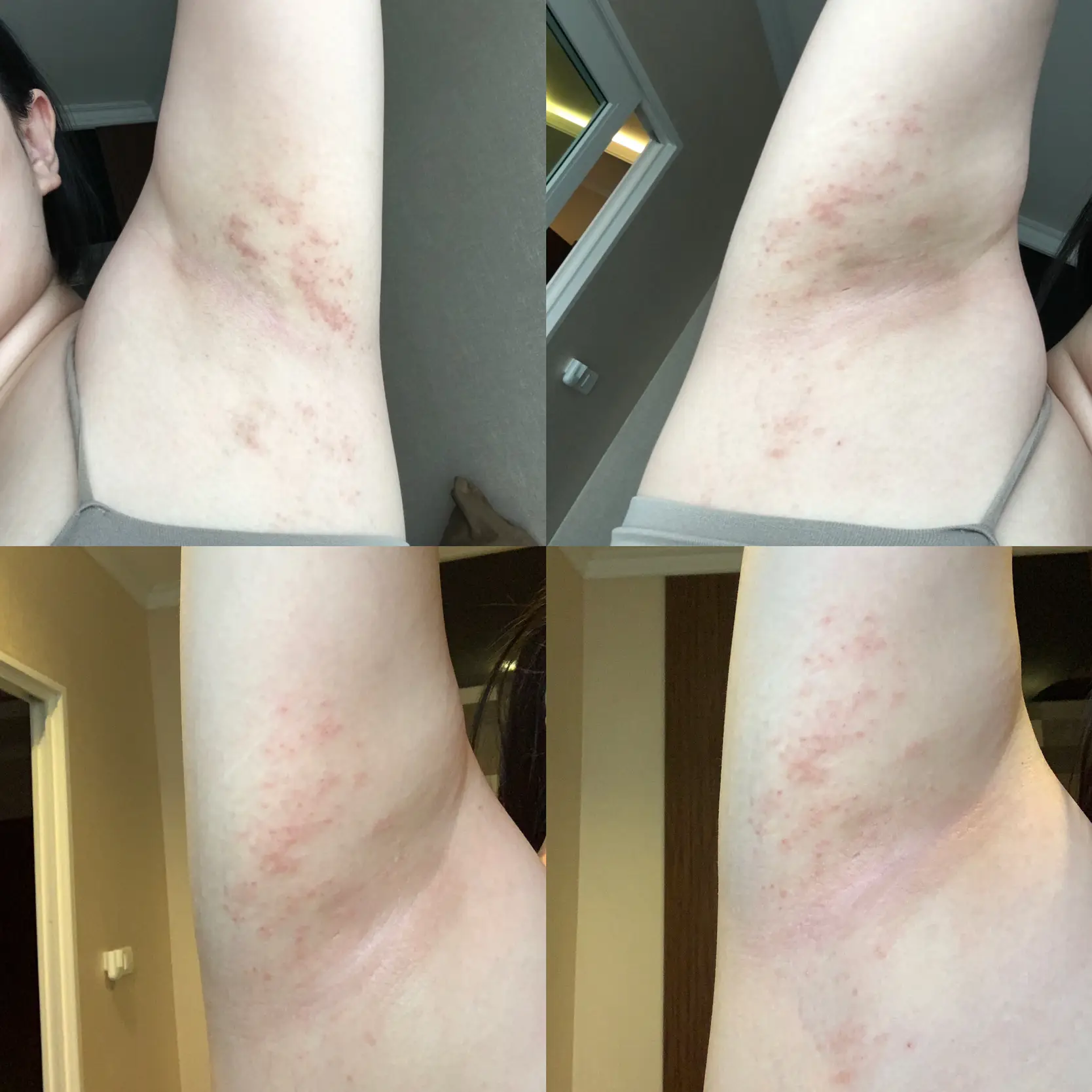 🫁😰เชียงใหม่ ปอดอักเสบไม่รู้ตัว ฝุ่น PM2.5 น่ากลัวกว่าที่เราคิด | แกลเลอรีที่โพสต์โดย Yokmoki ...