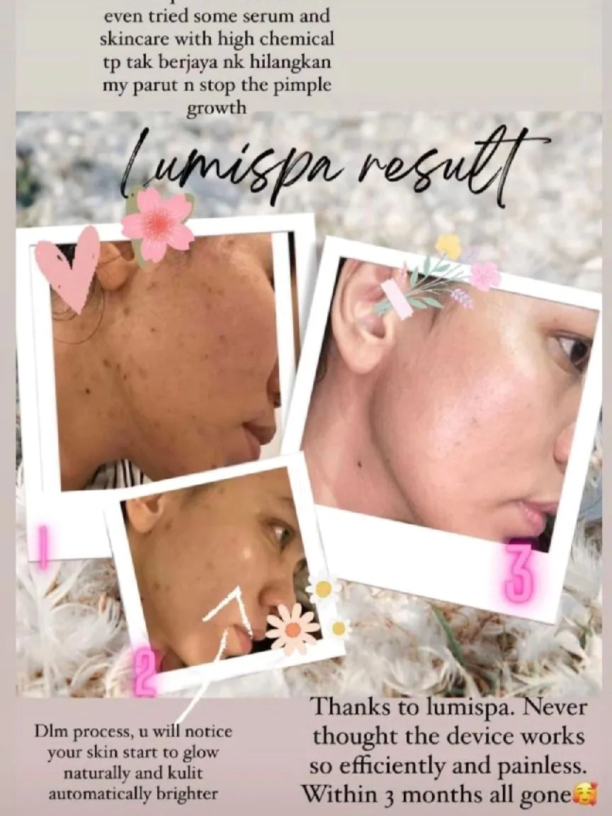 Lumi IO help my face glow | Galeri disiarkan oleh Serena Ong | Lemon8