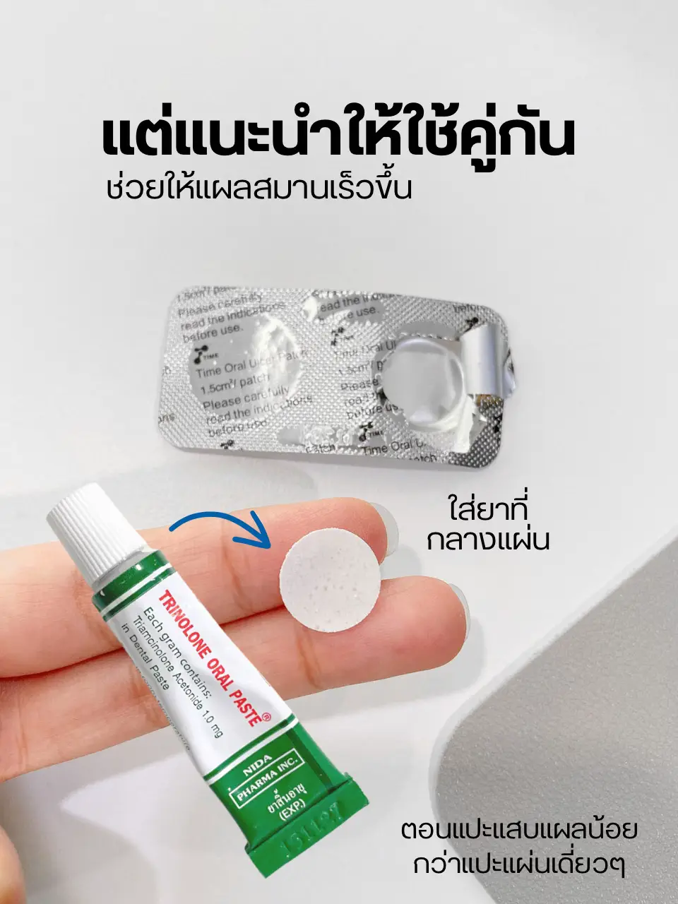 หมดปัญหา ยาแก้ร้อนในติดทุกอย่างยกเว้นติดแผล แก้ได้ด้วย…🫦🩹 แกลเลอรี
