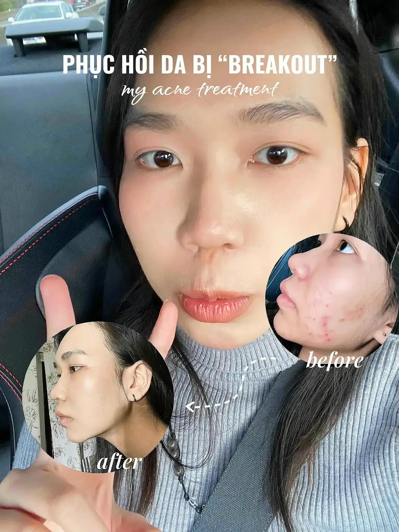 6 Bước dưỡng trắng da của mình | Bộ sưu tập do Nhật Hằng đăng | Lemon8