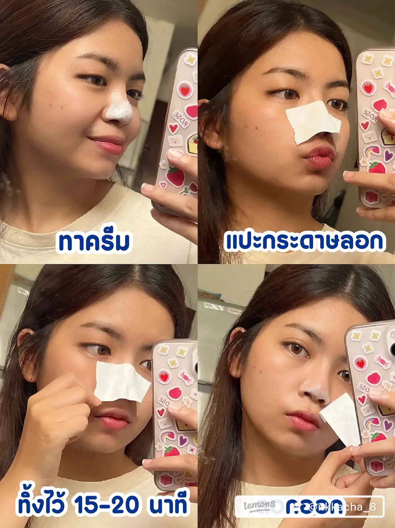 ลอกสิวเสี้ยนครั้งแรก หลังทำจมูก ‼️ | แกลเลอรีที่โพสต์โดย Kkacha | Lemon8