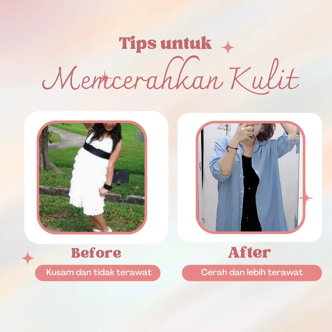 Tips Mencerahkan Kulit (Glow Up) ala Zey | Galeri diposting oleh Zey | Lemon8