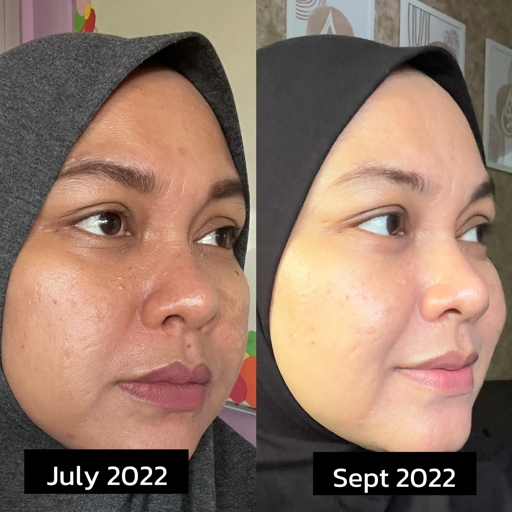 2 months journey | Galeri disiarkan oleh Nor Azwin Azlan | Lemon8