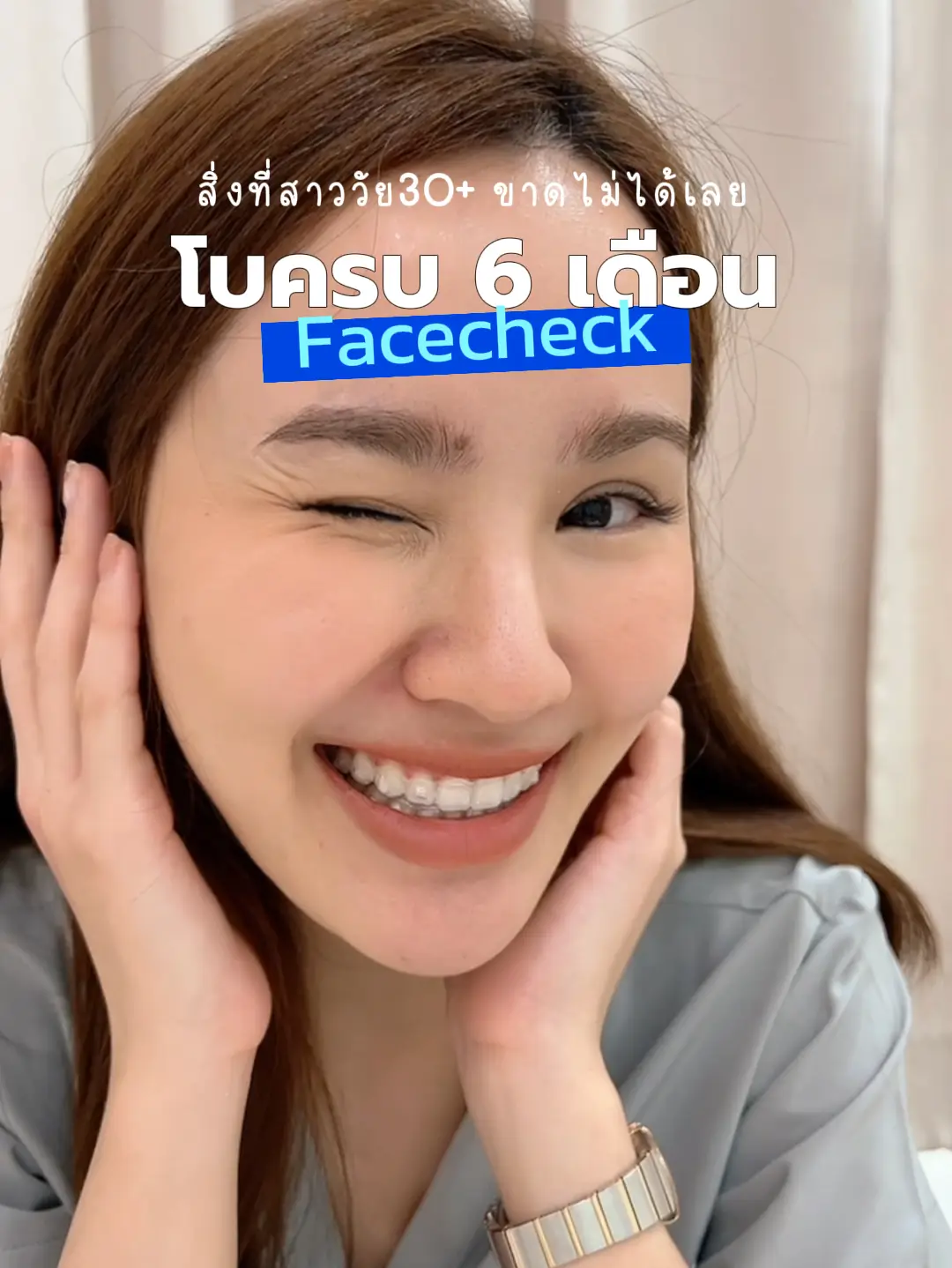 ฉีดโบครบ 6 เดือน ในวัย30+ | Video published by Thewika T. | Lemon8