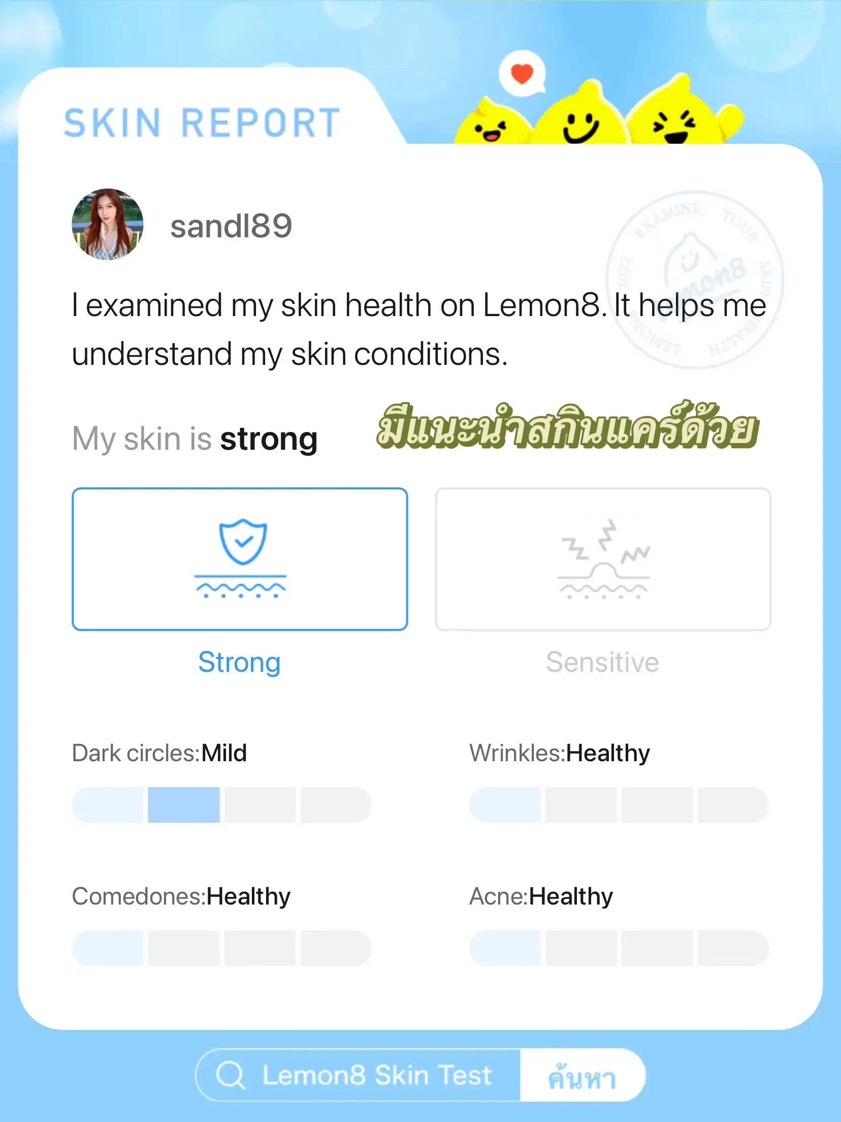 My Skin Report | แกลเลอรีที่โพสต์โดย SandyTms | Lemon8