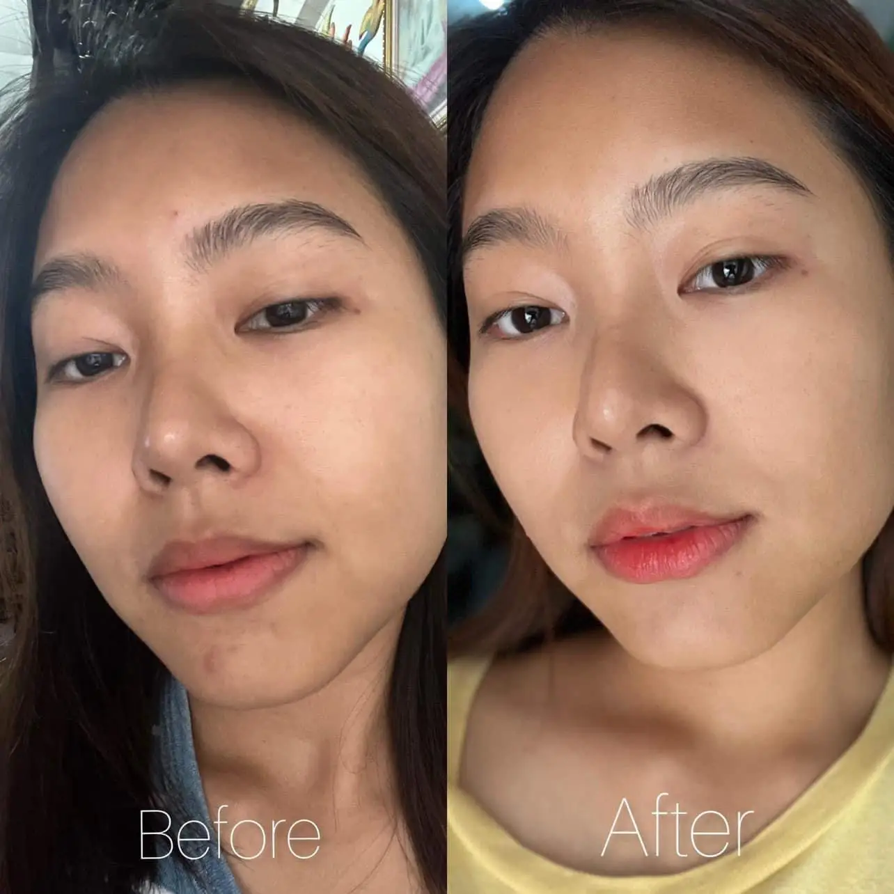 🌟 รีวิว INGU หลังใช้จนหมด !!! 🍒 | แกลเลอรีที่โพสต์โดย S P Y | Lemon8