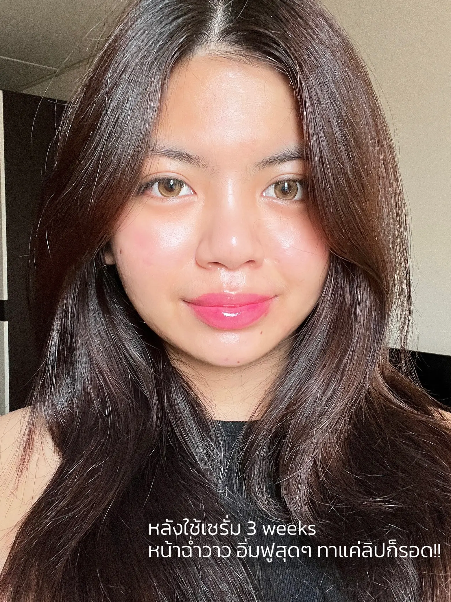 RACH PDRN เซรั่วผิวฉ่ำ ตัวตายตัวแทนเซรั่ม REJURAN !! | แกลเลอรีที่โพสต์ ...