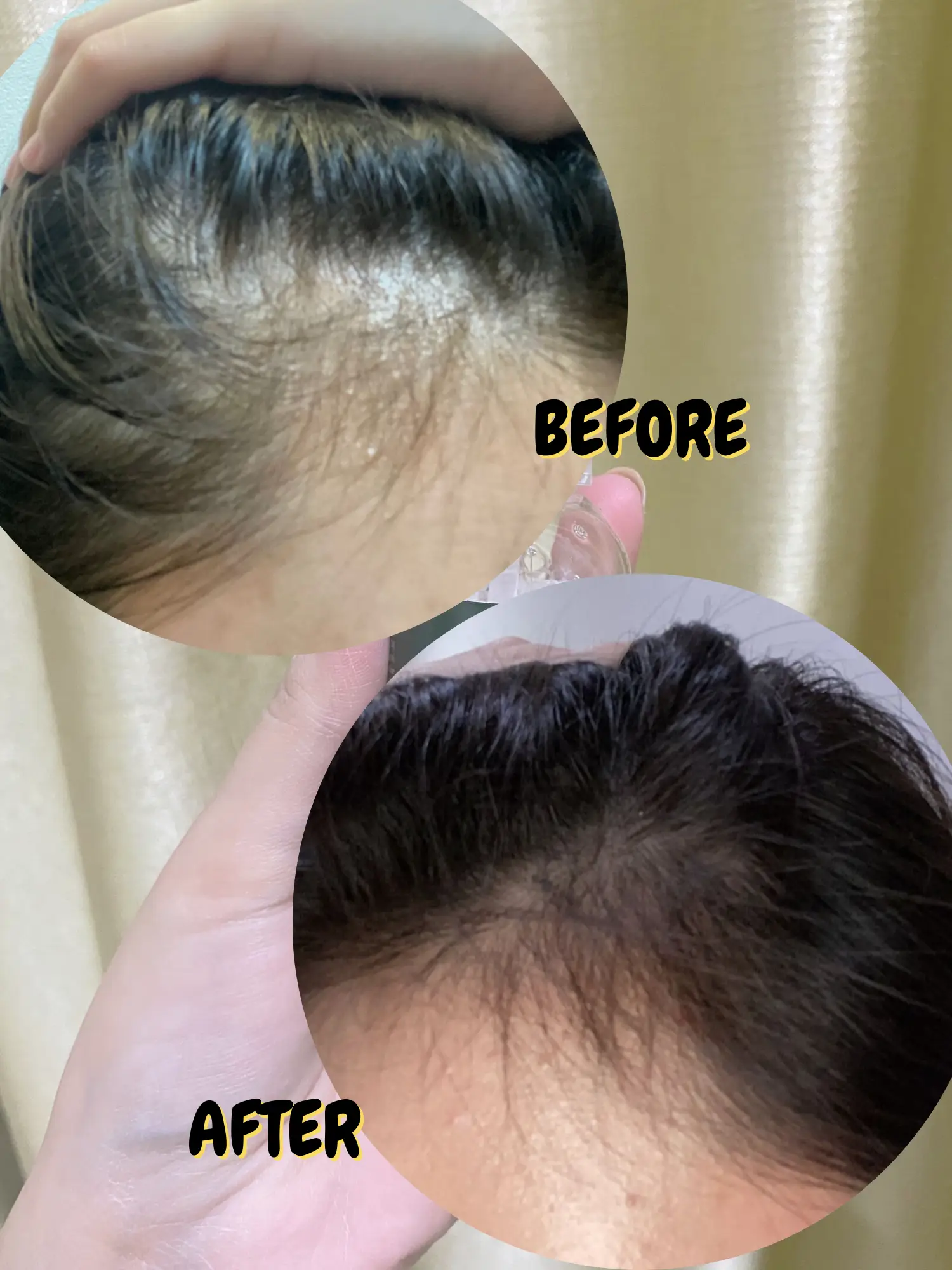 Tips & rekomendasi Rahasia Rambut LEBAT💆🏻‍♀️💃 | Galeri diposting oleh ...