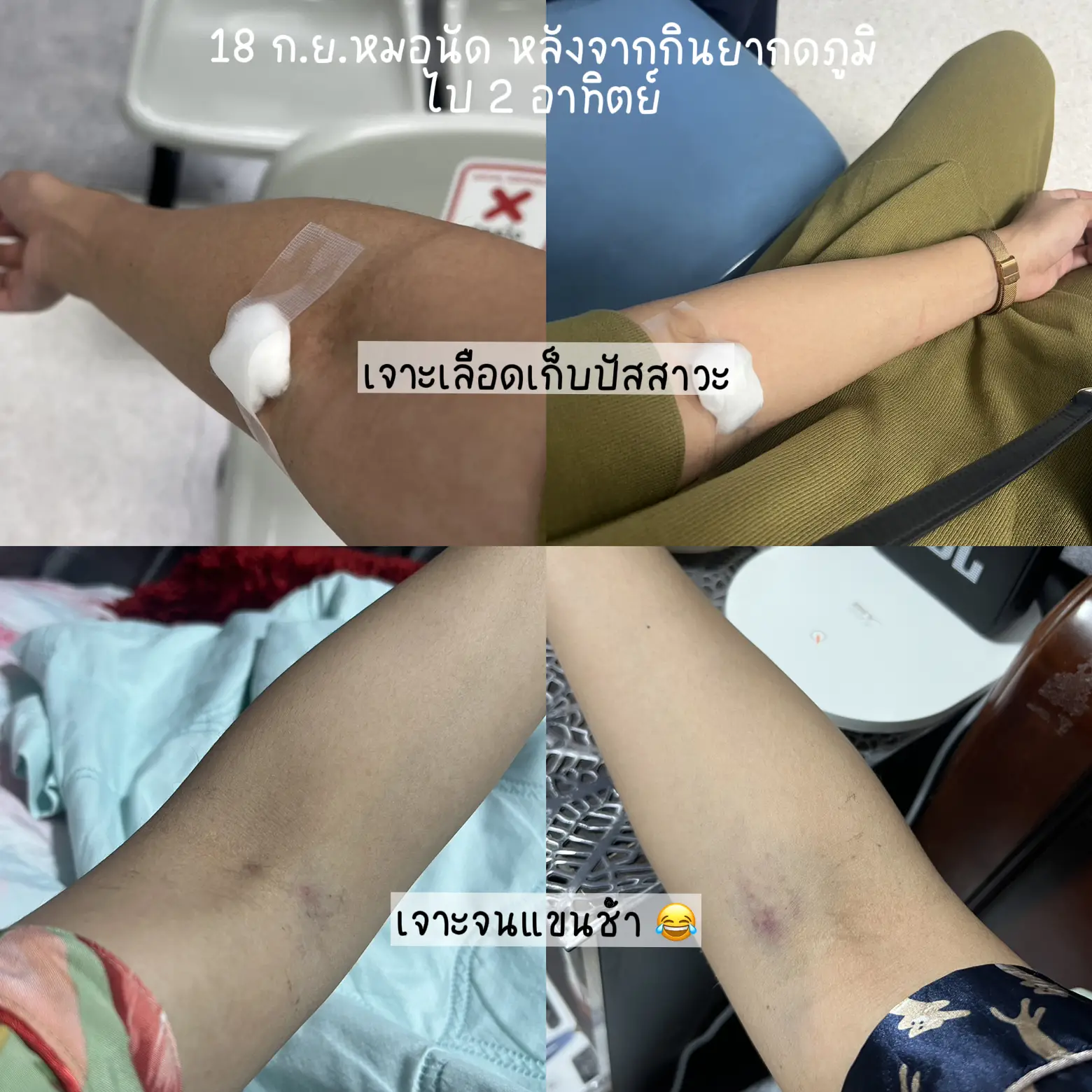 ใครจะคิดว่าตัวเองจะเป็นโรคพุ่มพวง!!!!! | แกลเลอรีที่โพสต์โดย iammaii________ | Lemon8