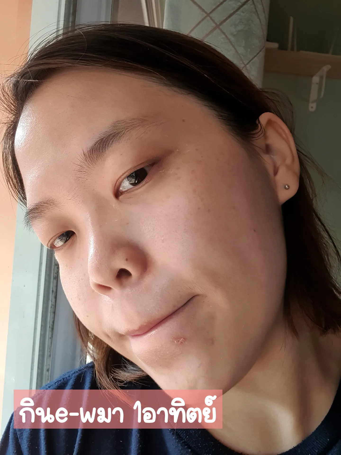 รีวิวอาหารเสริมe-W - การค้นหาใน Lemon8