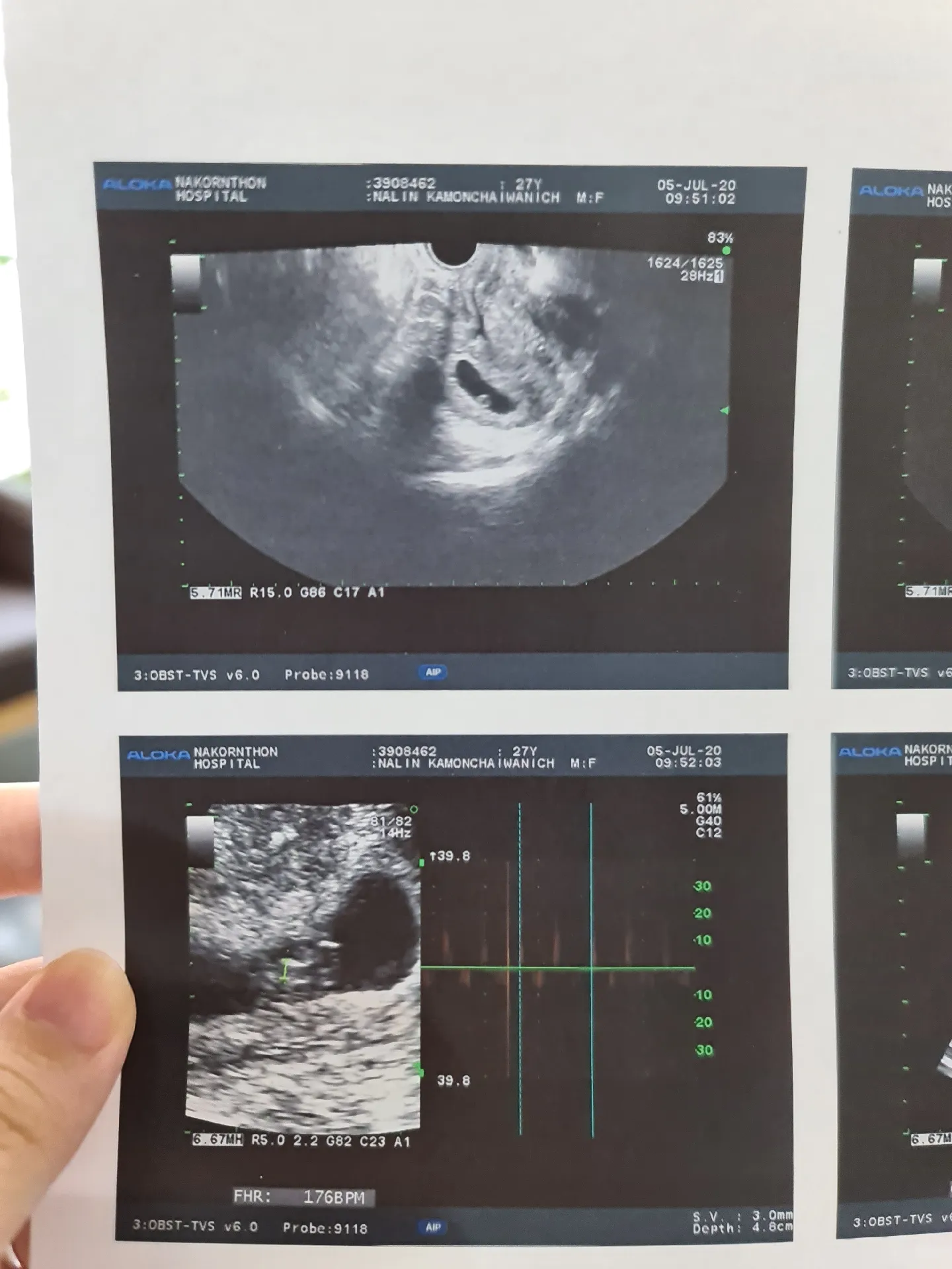 ตัวย่อบนผลอัลตร้าซาวด์แปลว่าอะไรบ้างน้าา | แกลเลอรีที่โพสต์โดย ...