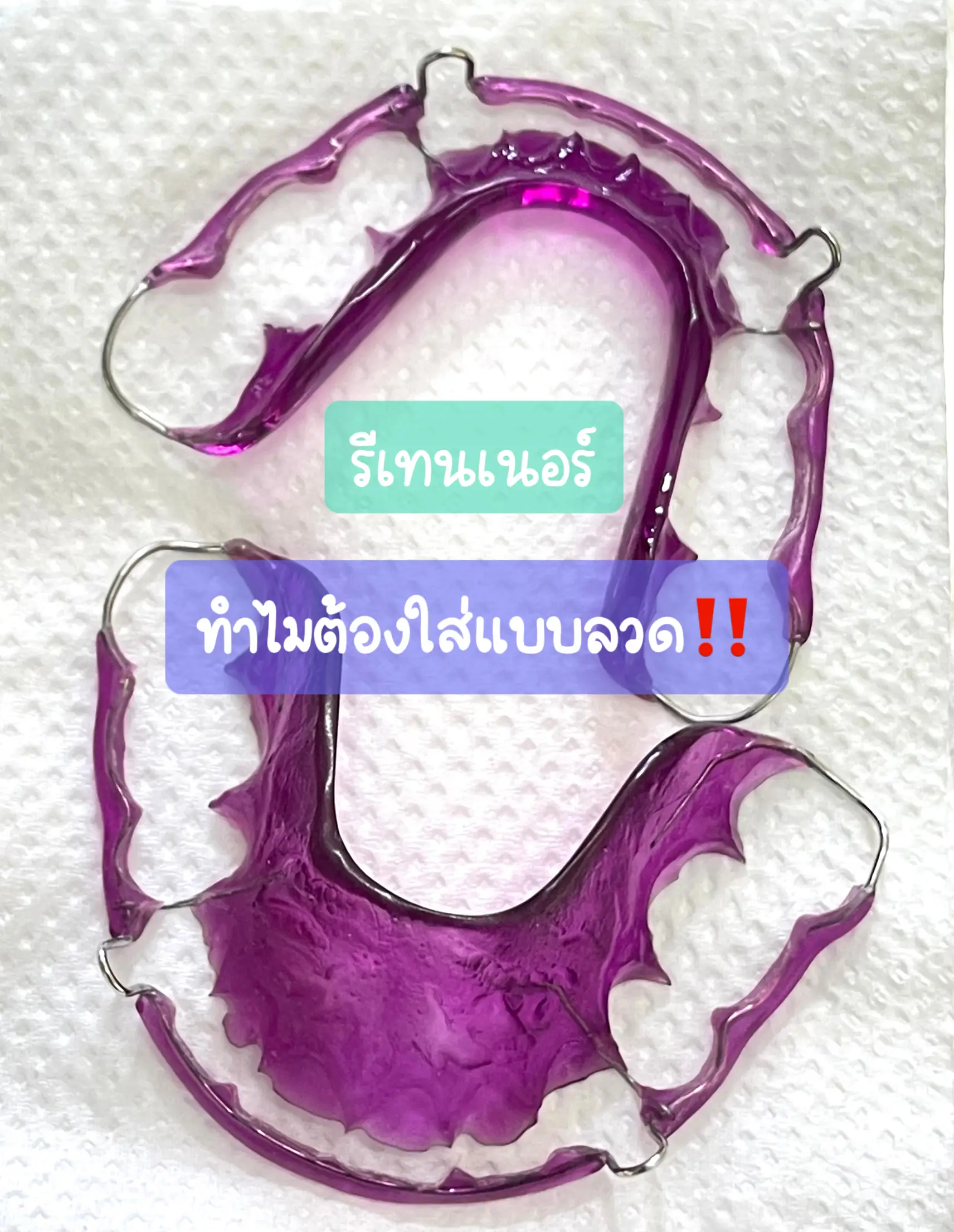 รีเทนเนอร์แบบลวดไร้ท่อ ราคา - การค้นหาใน Lemon8