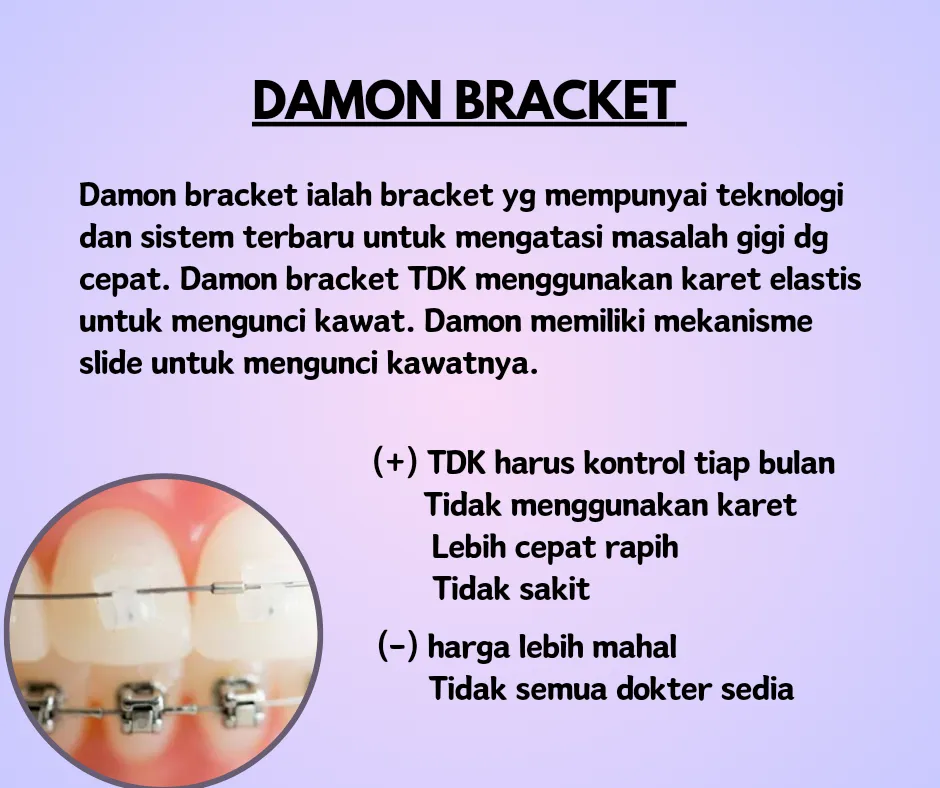 model behel - Pencarian Lemon8