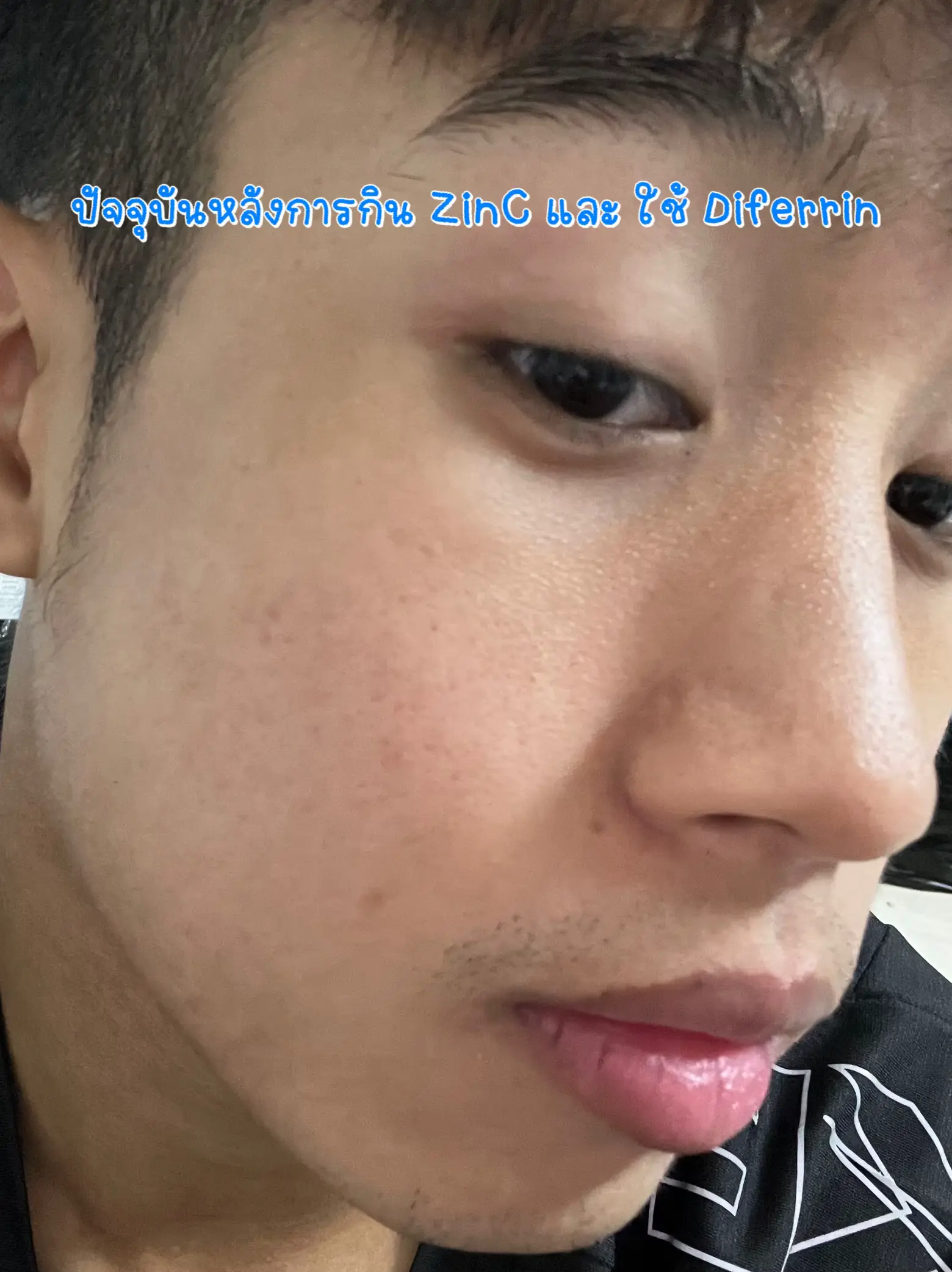 รีวิวzinc - การค้นหาใน Lemon8