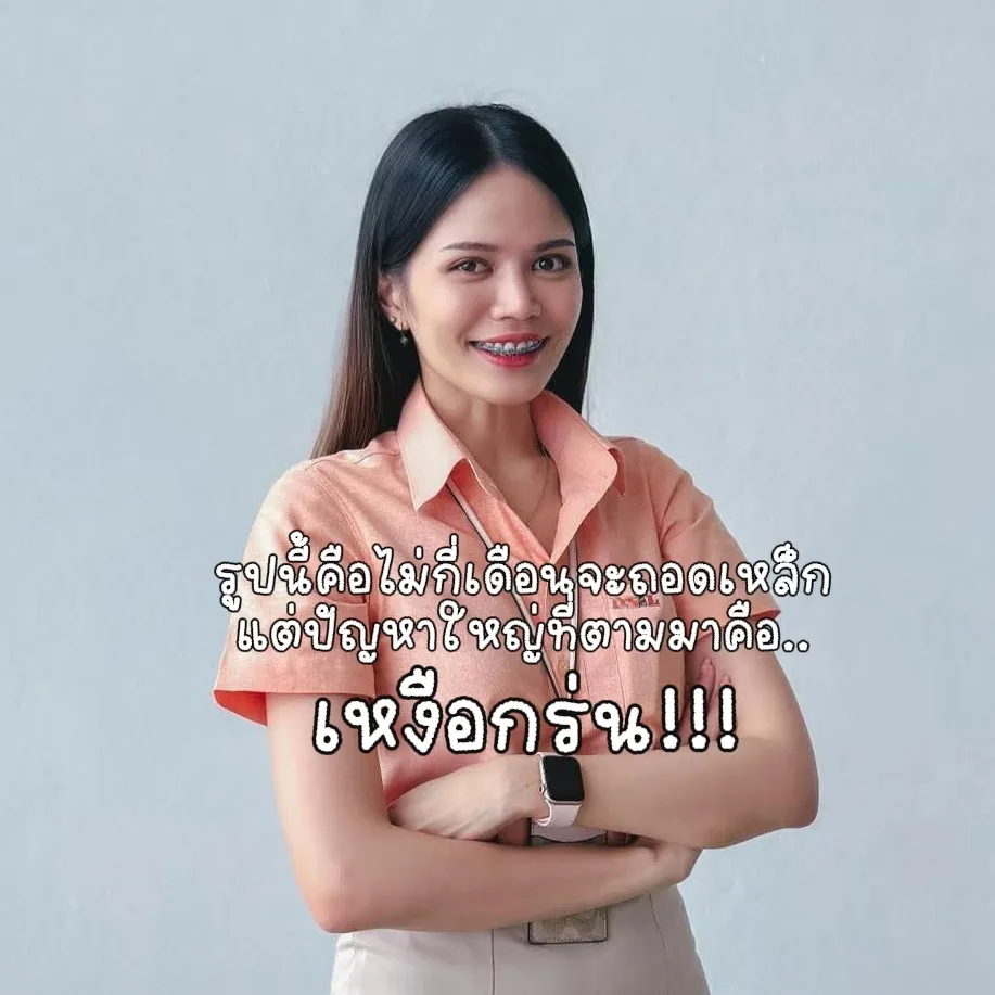 รีวิว จัดฟัน ฉบับคนถอนออก 6 ซี่ | แกลเลอรีที่โพสต์โดย Vila’s Story | Lemon8