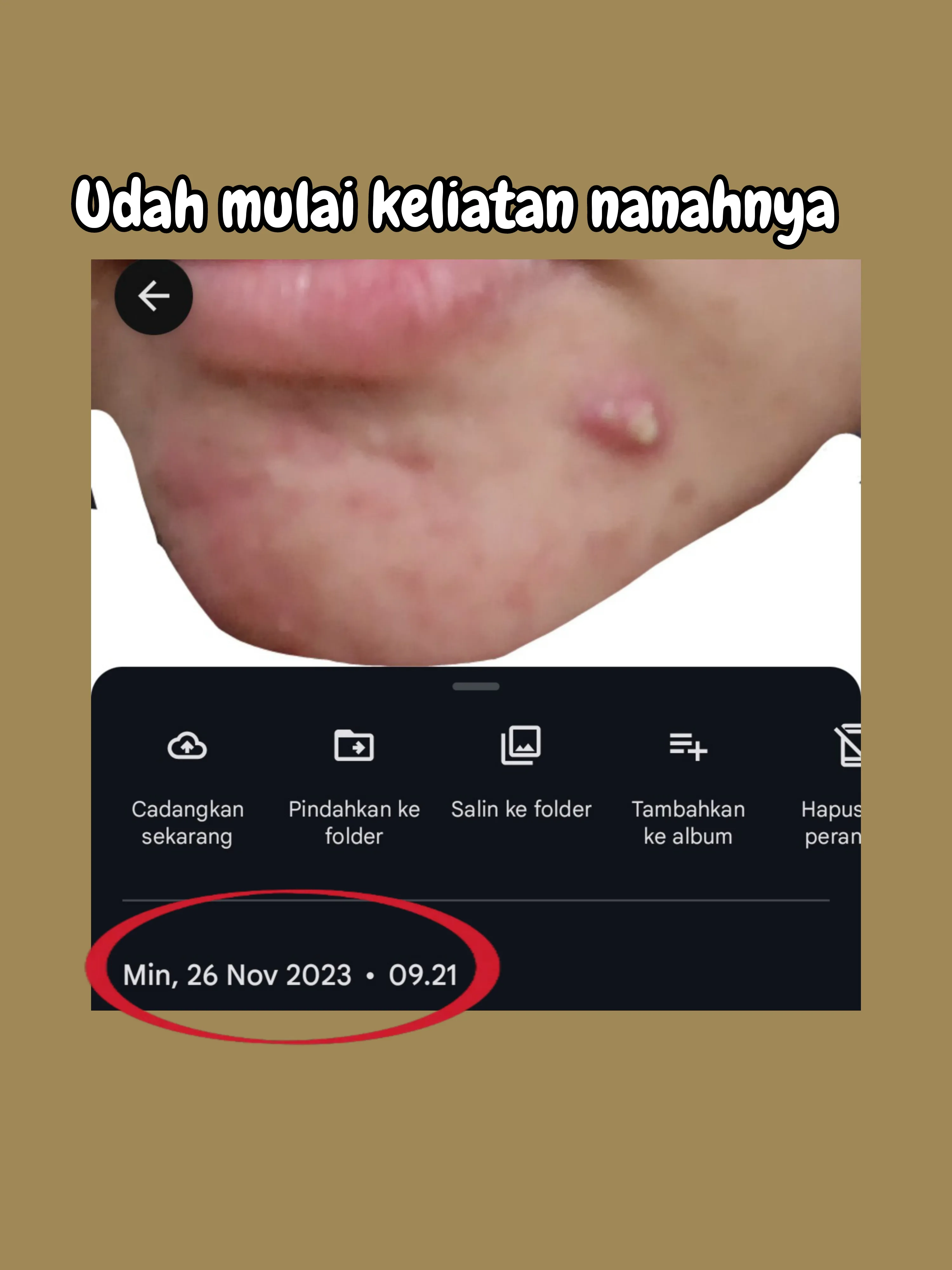 cobain endog ajaib banyak manfaat | Galeri diposting oleh 𝓜𝓸𝓬𝓬𝓪☕ | Lemon8